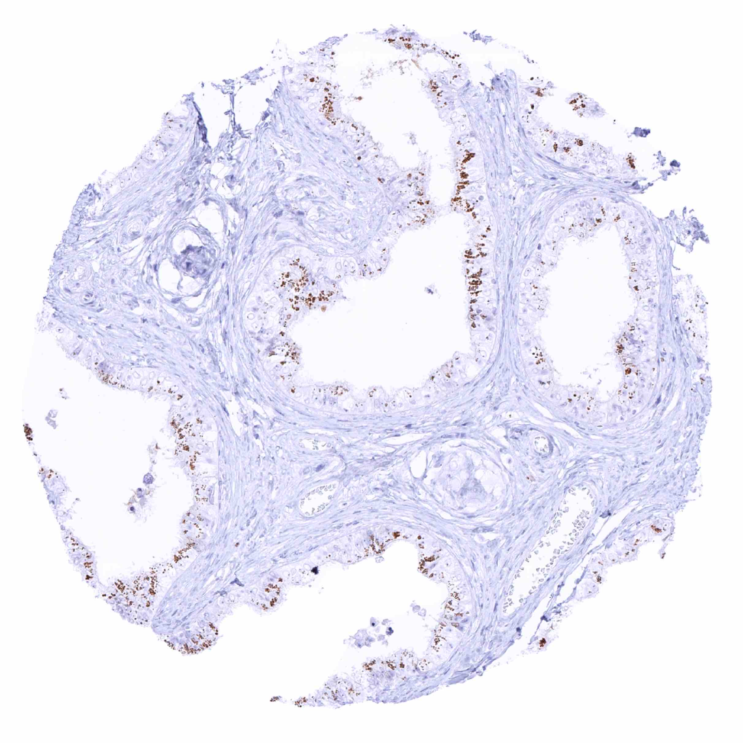 GAD2 / GAD65 (MSVA-602M) - MS Validated Antibodies