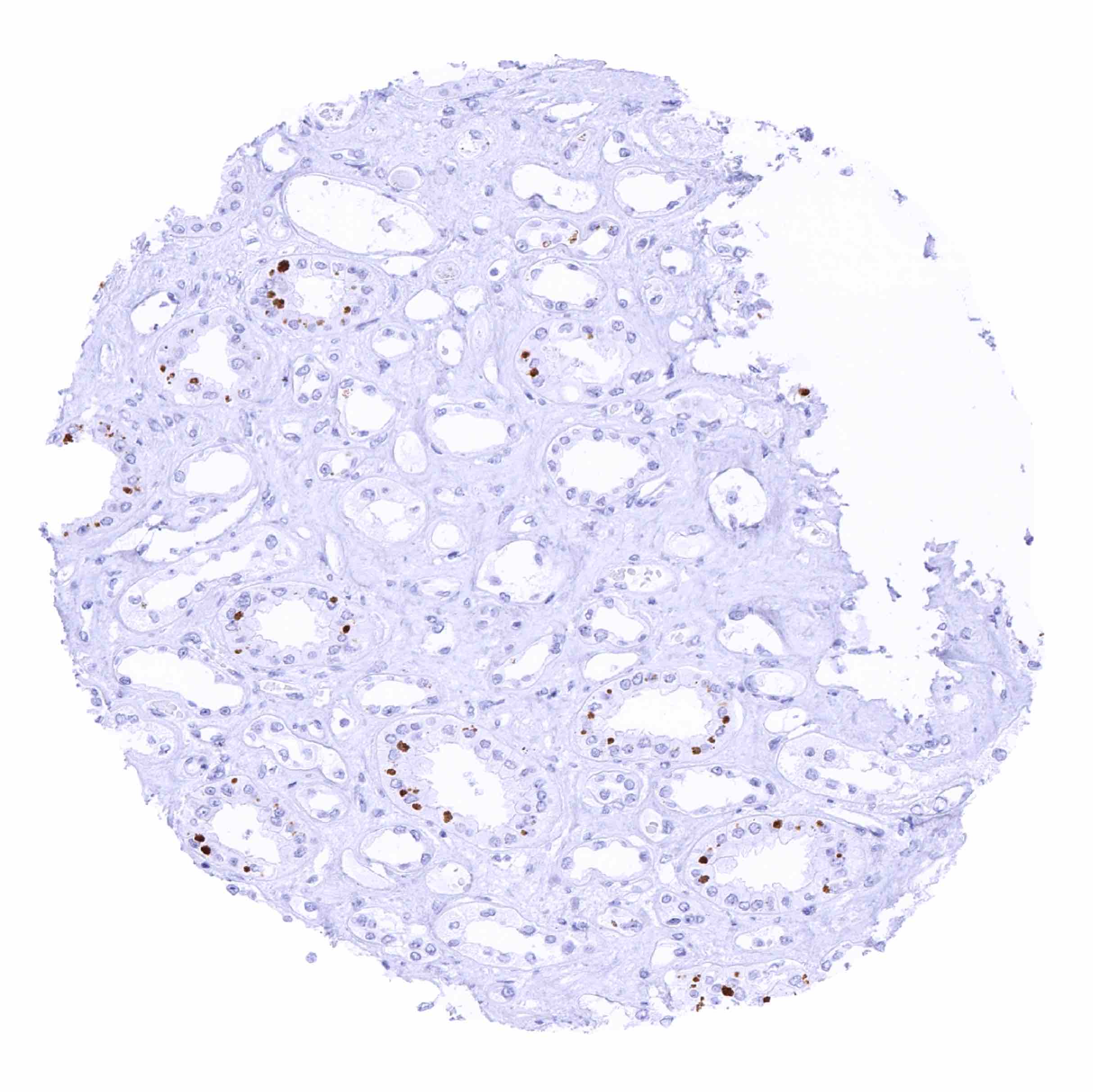 GAD2 / GAD65 (MSVA-602M) - MS Validated Antibodies