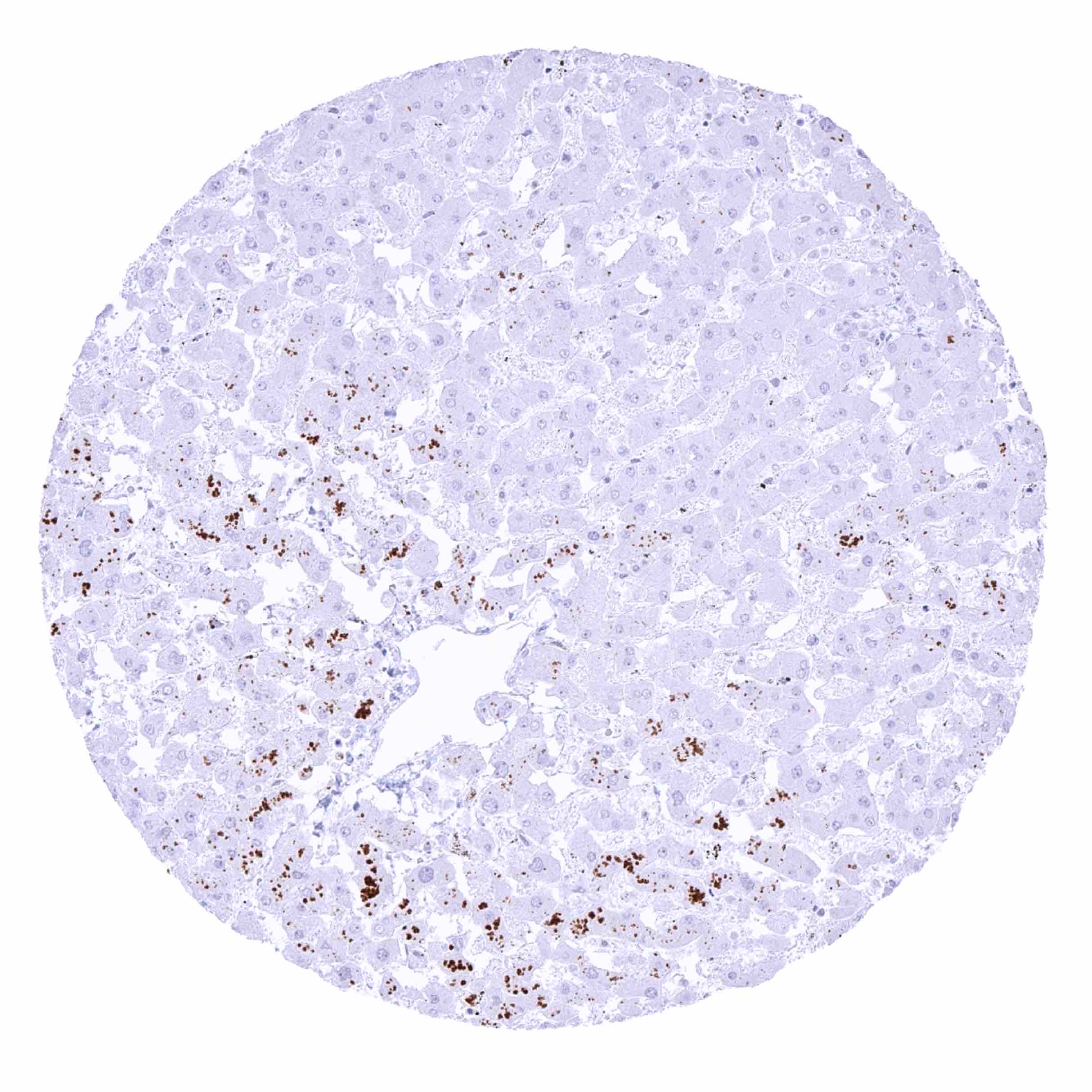 GAD2 / GAD65 (MSVA-602M) - MS Validated Antibodies