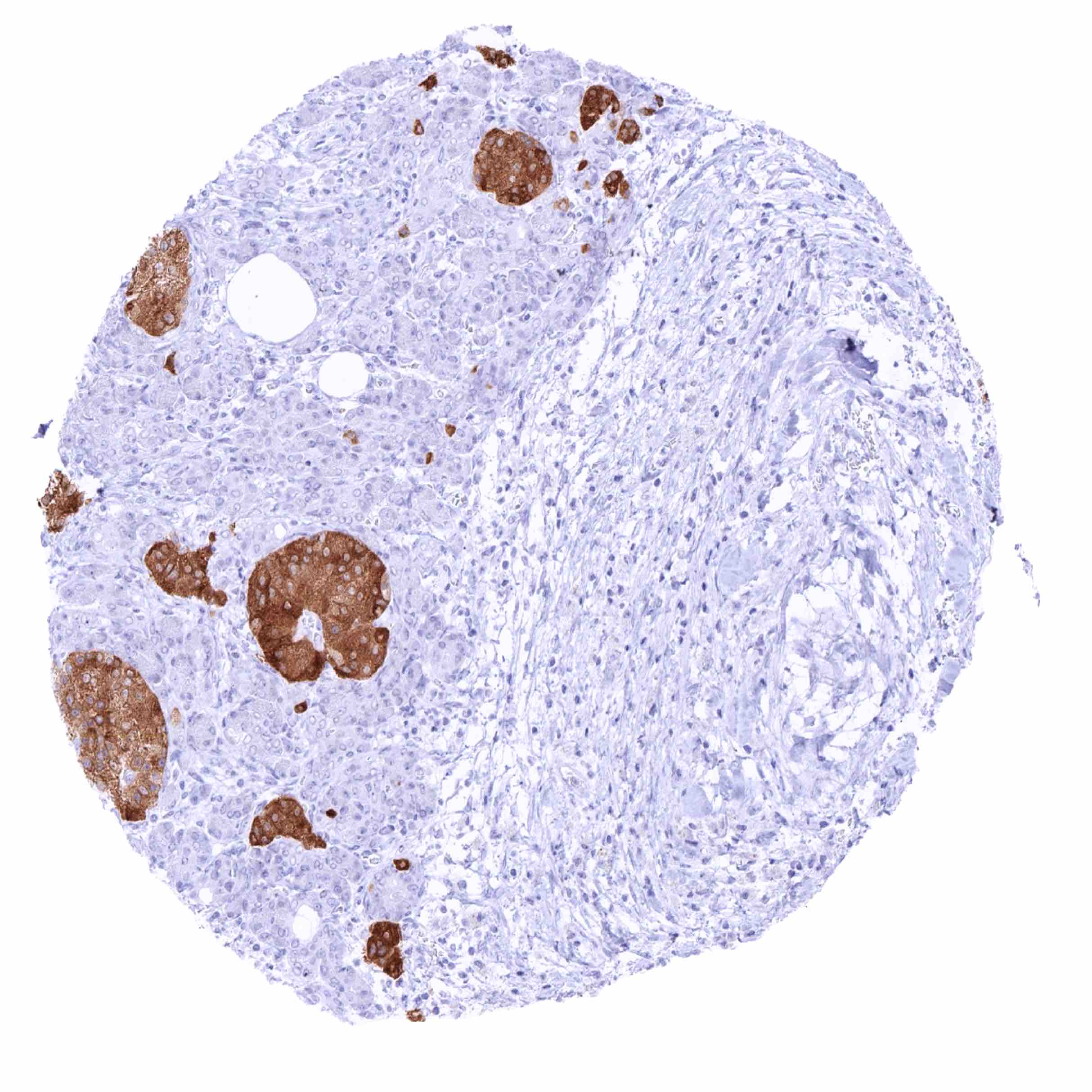 GAD2 / GAD65 (MSVA-602M) - MS Validated Antibodies