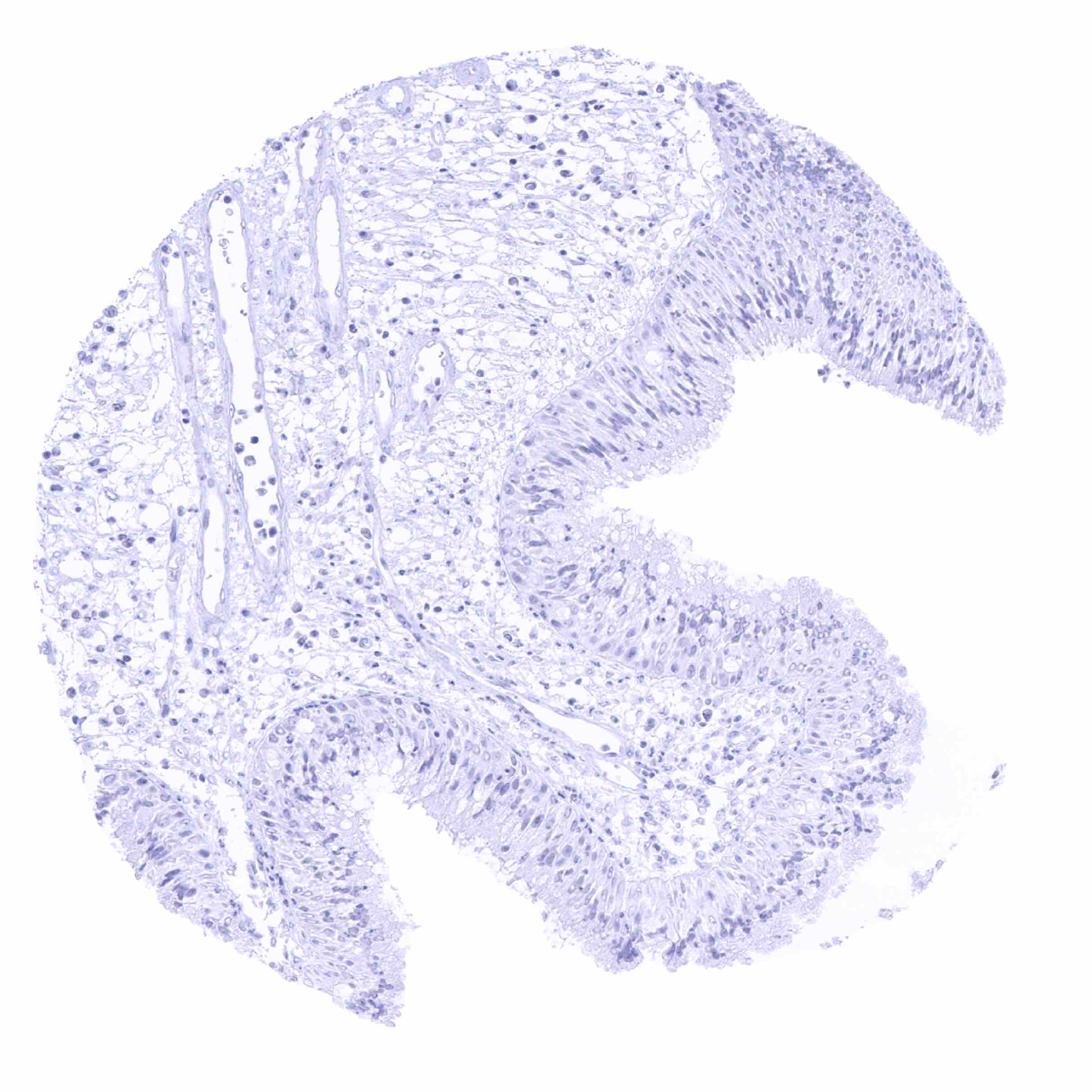 GAD2 / GAD65 (MSVA-602M) - MS Validated Antibodies