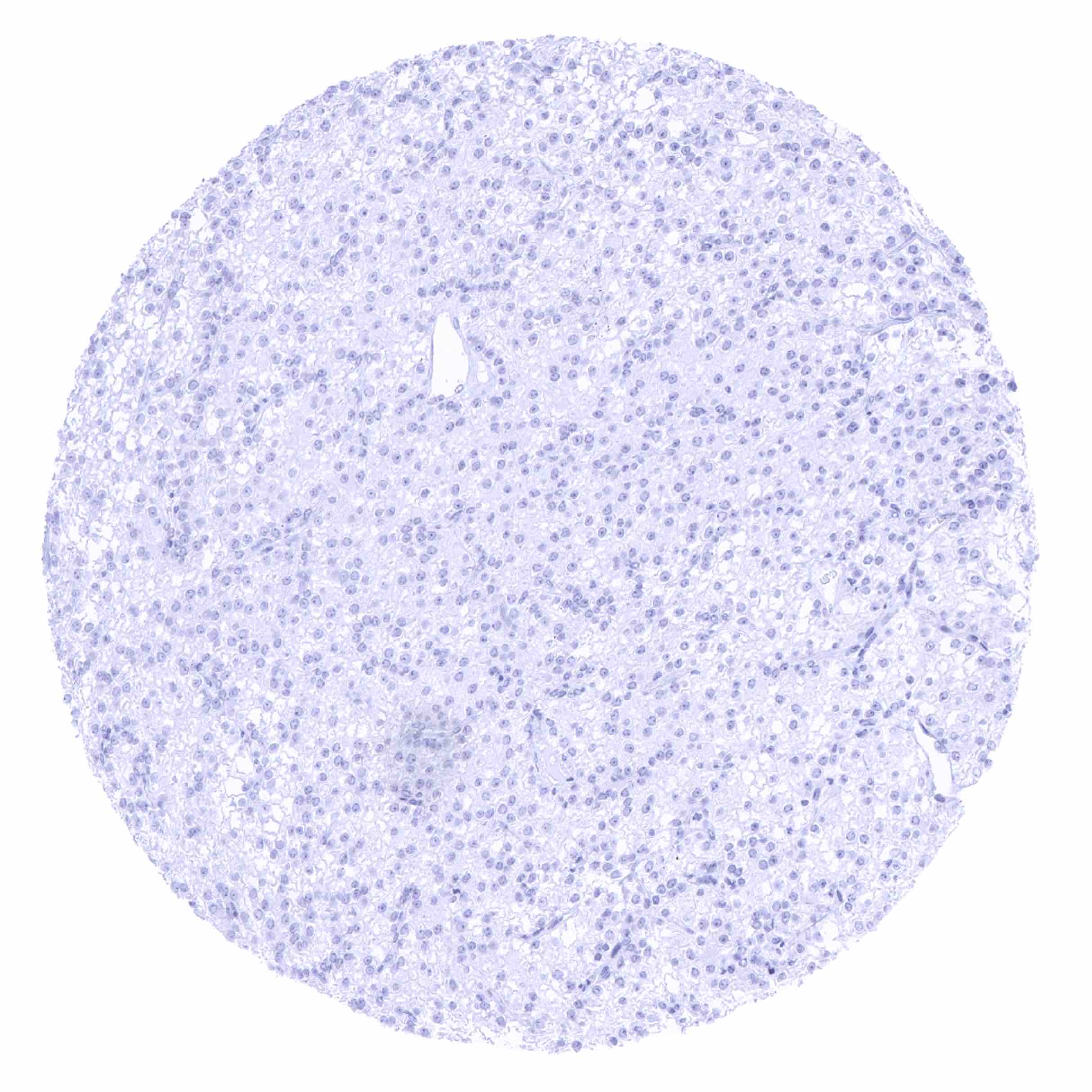 GAD2 / GAD65 (MSVA-602M) - MS Validated Antibodies
