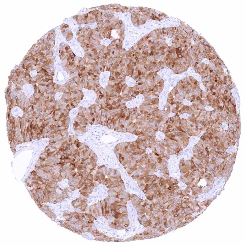 GAD2 / GAD65 (MSVA-602M) - MS Validated Antibodies