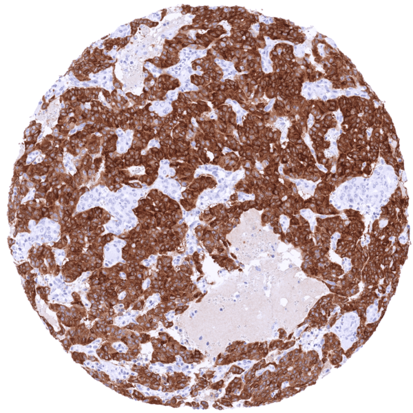 GAD2 / GAD65 (MSVA-602M) - MS Validated Antibodies