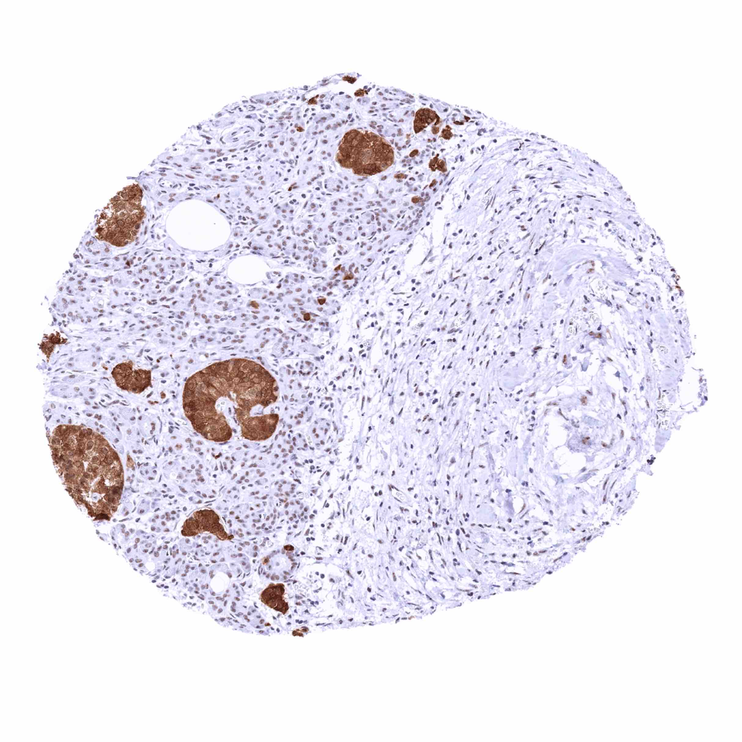 GAD2 / GAD65 (MSVA-602M) - MS Validated Antibodies