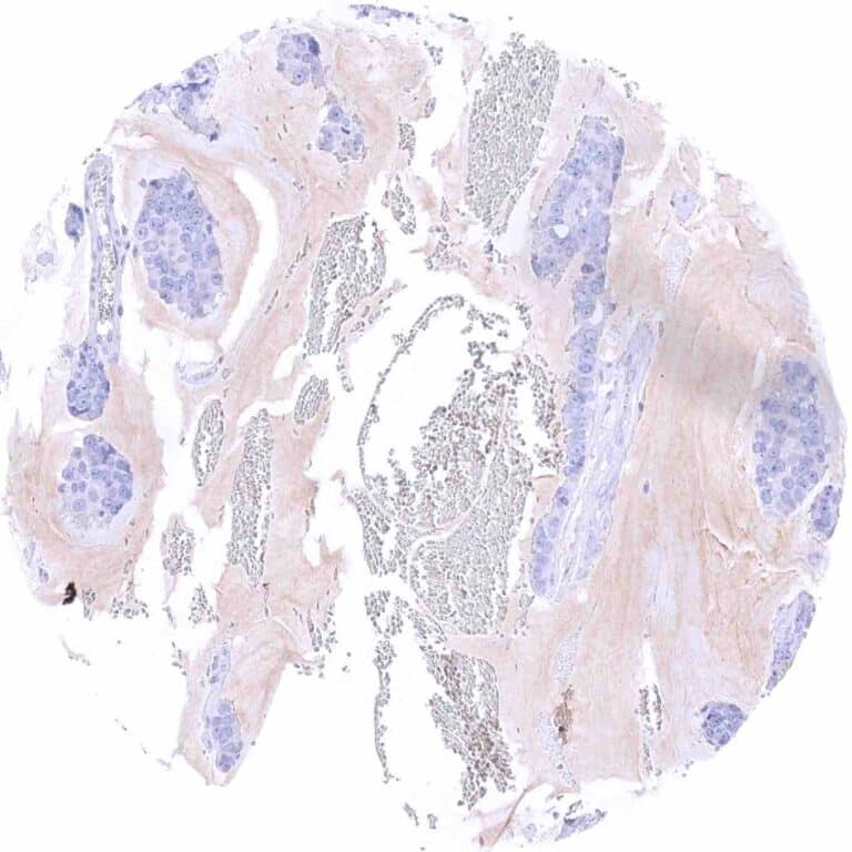 Cancer Tissue Gallery IgD - MS Validated Antibodies