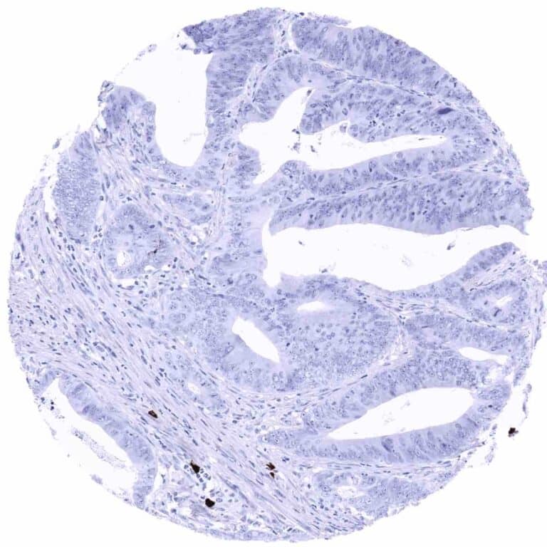 Cancer Tissue Gallery IgD - MS Validated Antibodies