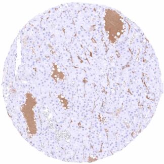 Cancer Tissue Gallery IgD - MS Validated Antibodies