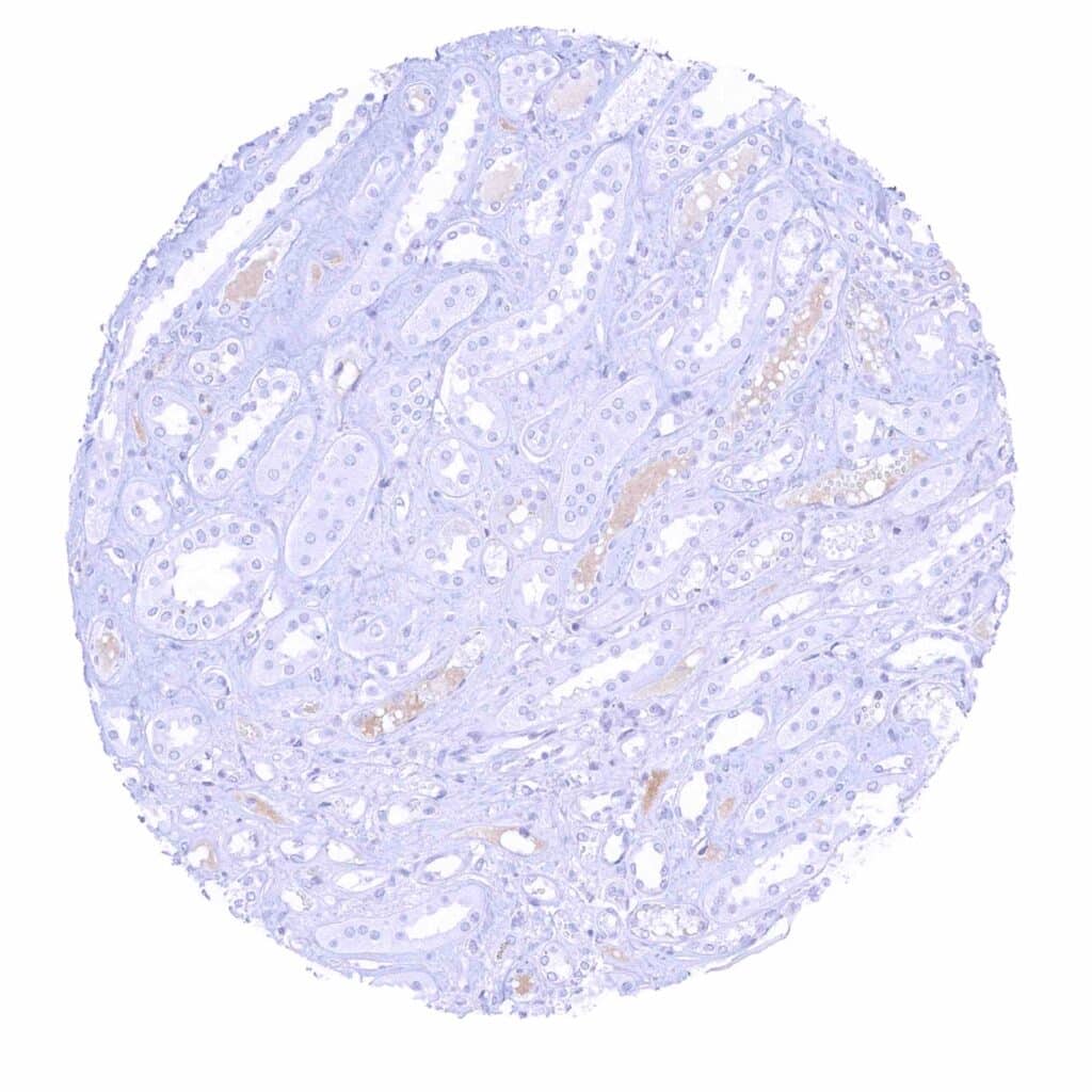 IgD (Immunglobulin D) (MSVA-701R) - MS Validated Antibodies IgD (Immunglobulin D) (MSVA-701R) - MS Validated Antibodies