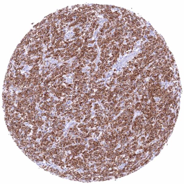Cancer Tissue Gallery IgD - MS Validated Antibodies