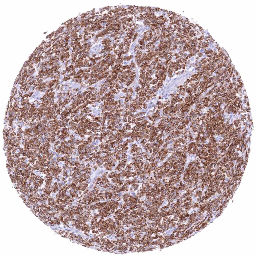 IgD (Immunglobulin D) (MSVA-701R) - MS Validated Antibodies