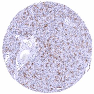 Cancer Tissue Gallery IgD - MS Validated Antibodies