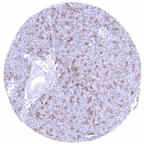 Cancer Tissue Gallery Igd Ms Validated Antibodies 7466