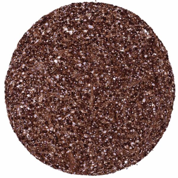 Cancer Tissue Gallery IgD - MS Validated Antibodies