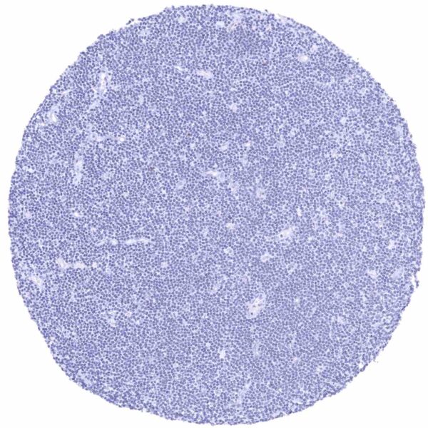 Cancer Tissue Gallery IgD - MS Validated Antibodies