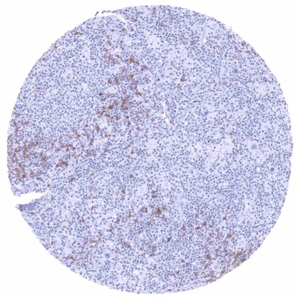 Cancer Tissue Gallery IgD - MS Validated Antibodies