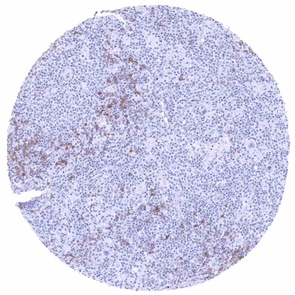 IgD (Immunglobulin D) (MSVA-701R) - MS Validated Antibodies IgD (Immunglobulin D) (MSVA-701R) - MS Validated Antibodies