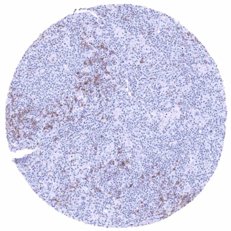 IgD (Immunglobulin D) (MSVA-701R) - MS Validated Antibodies