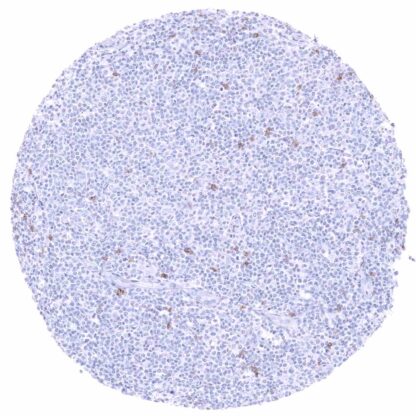 Cancer Tissue Gallery IgD - MS Validated Antibodies