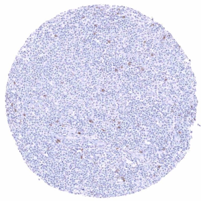 Cancer Tissue Gallery IgD - MS Validated Antibodies