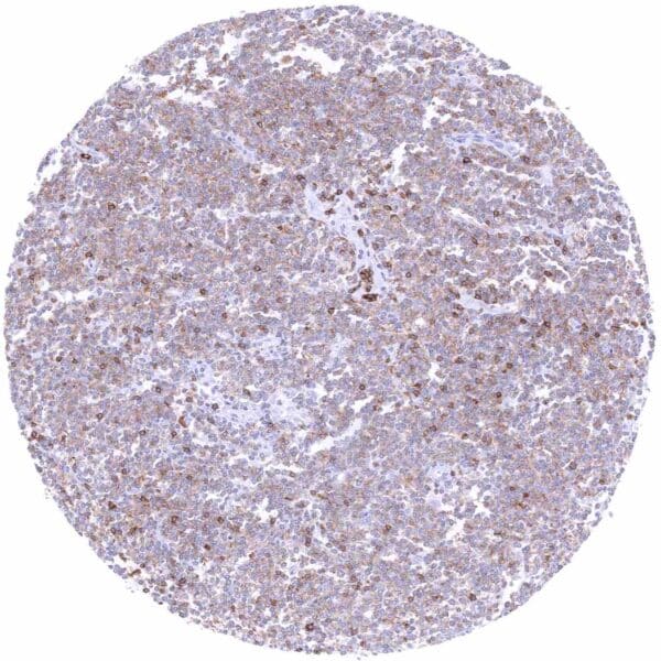 Cancer Tissue Gallery IgD - MS Validated Antibodies