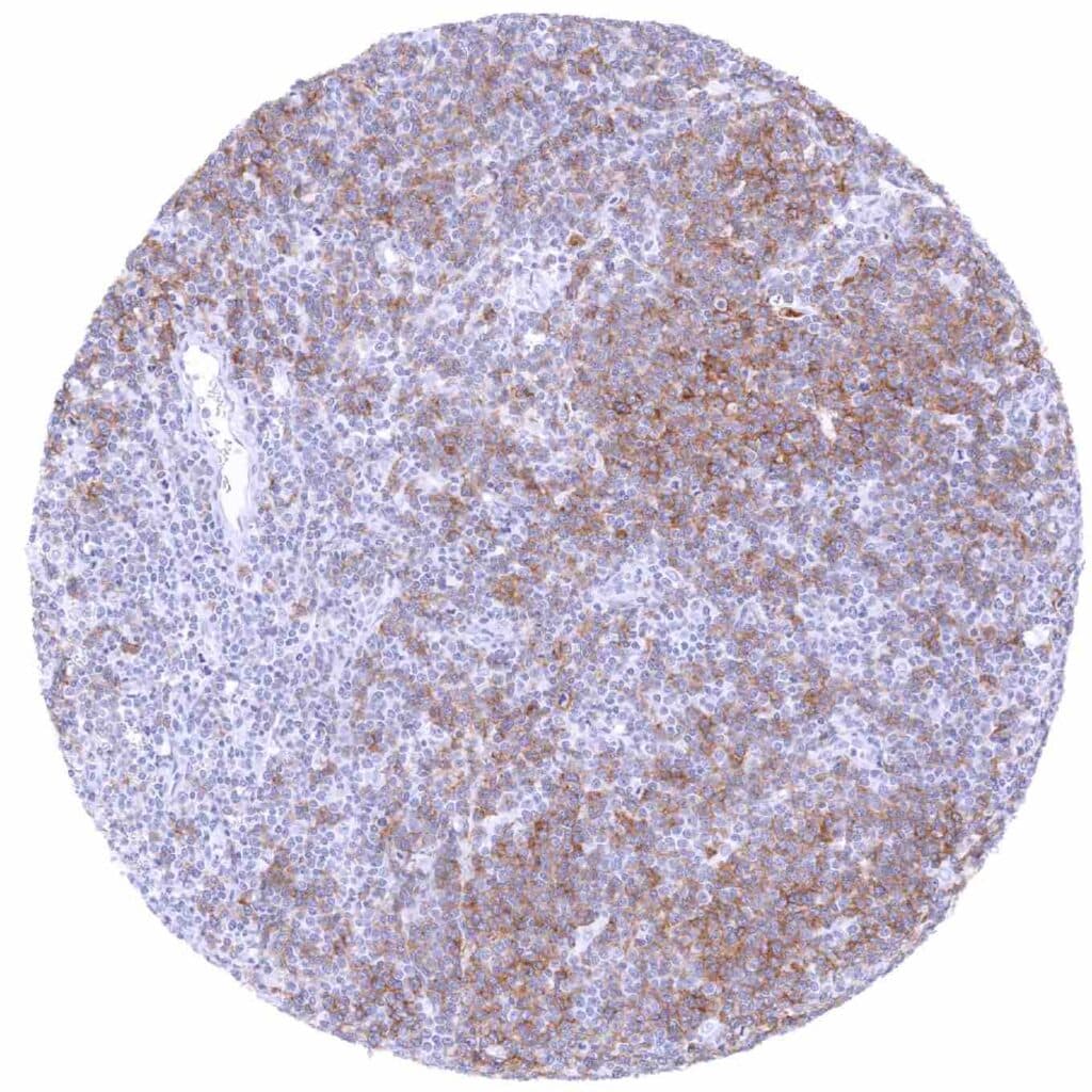 IgD (Immunglobulin D) (MSVA-701R) - MS Validated Antibodies