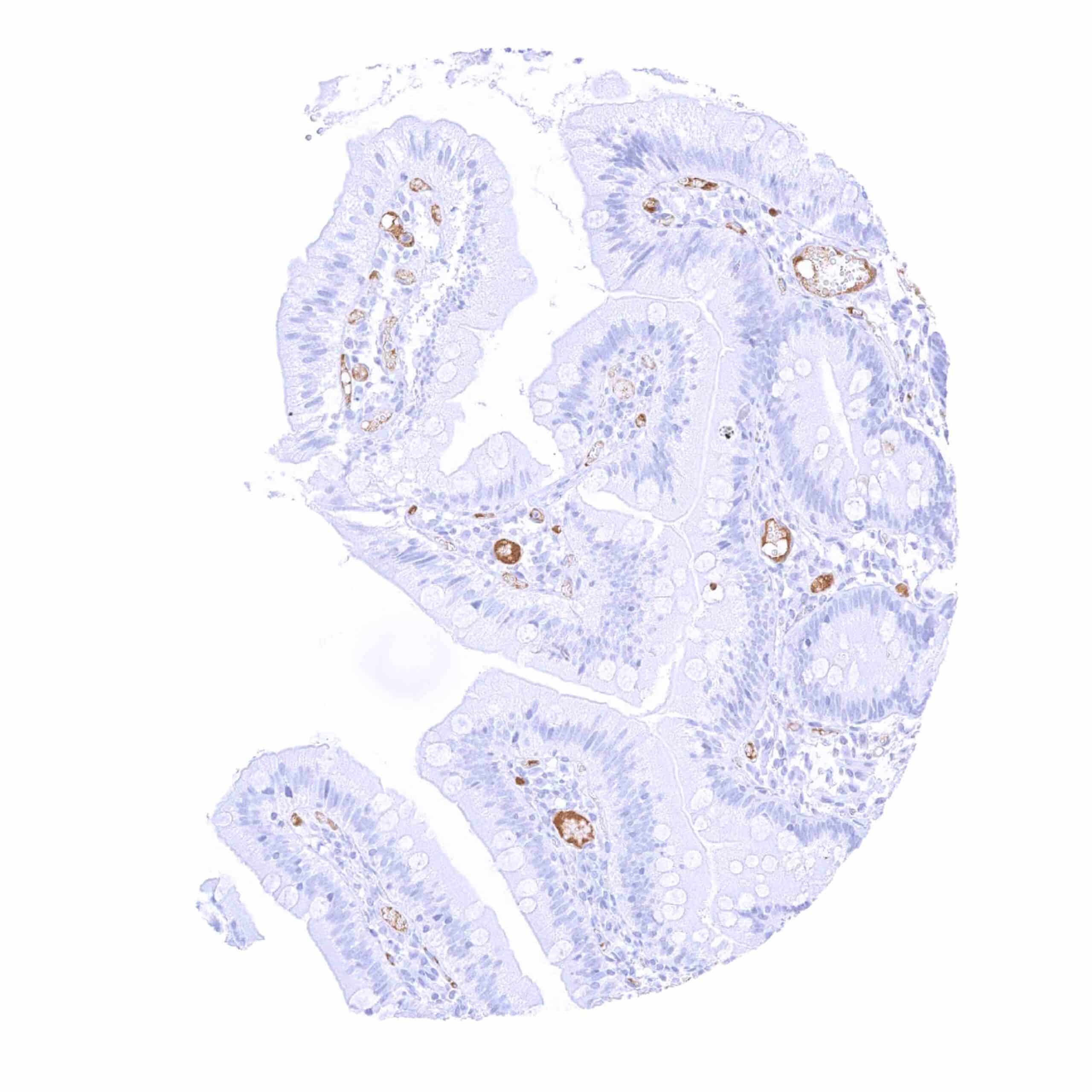 IgD (Immunglobulin D) (MSVA-701R) - MS Validated Antibodies
