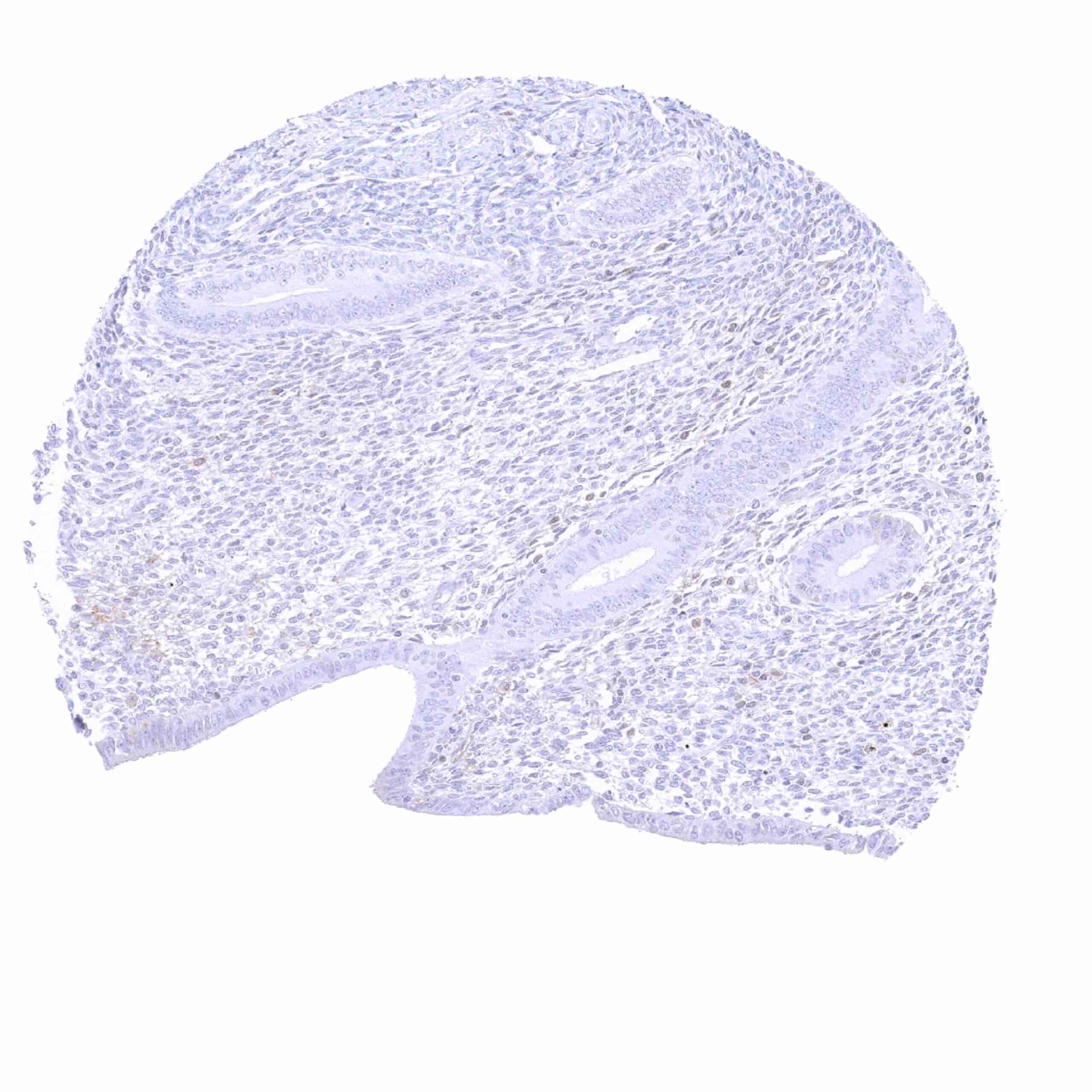IgD (Immunglobulin D) (MSVA-701R) - MS Validated Antibodies