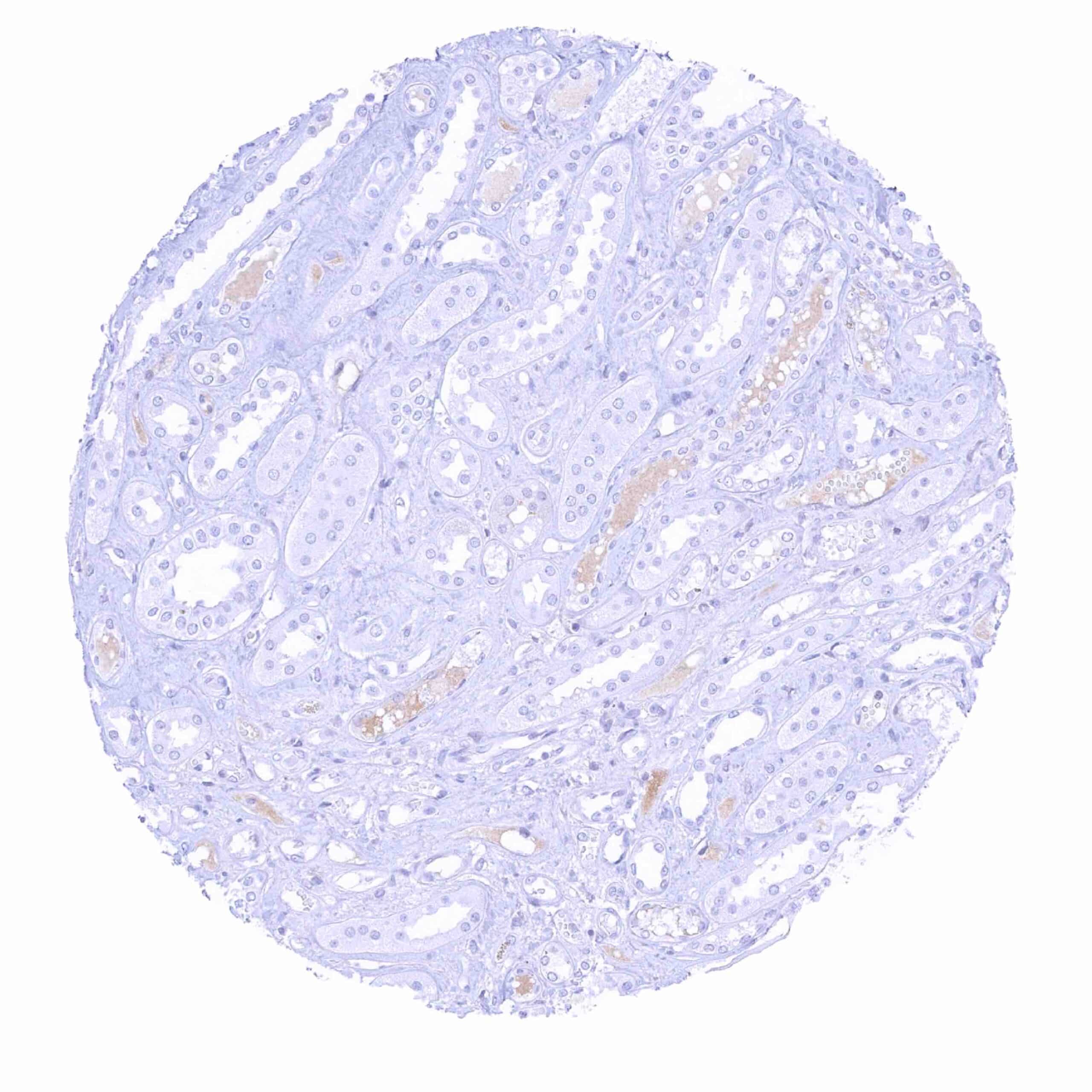 IgD (Immunglobulin D) (MSVA-701R) - MS Validated Antibodies