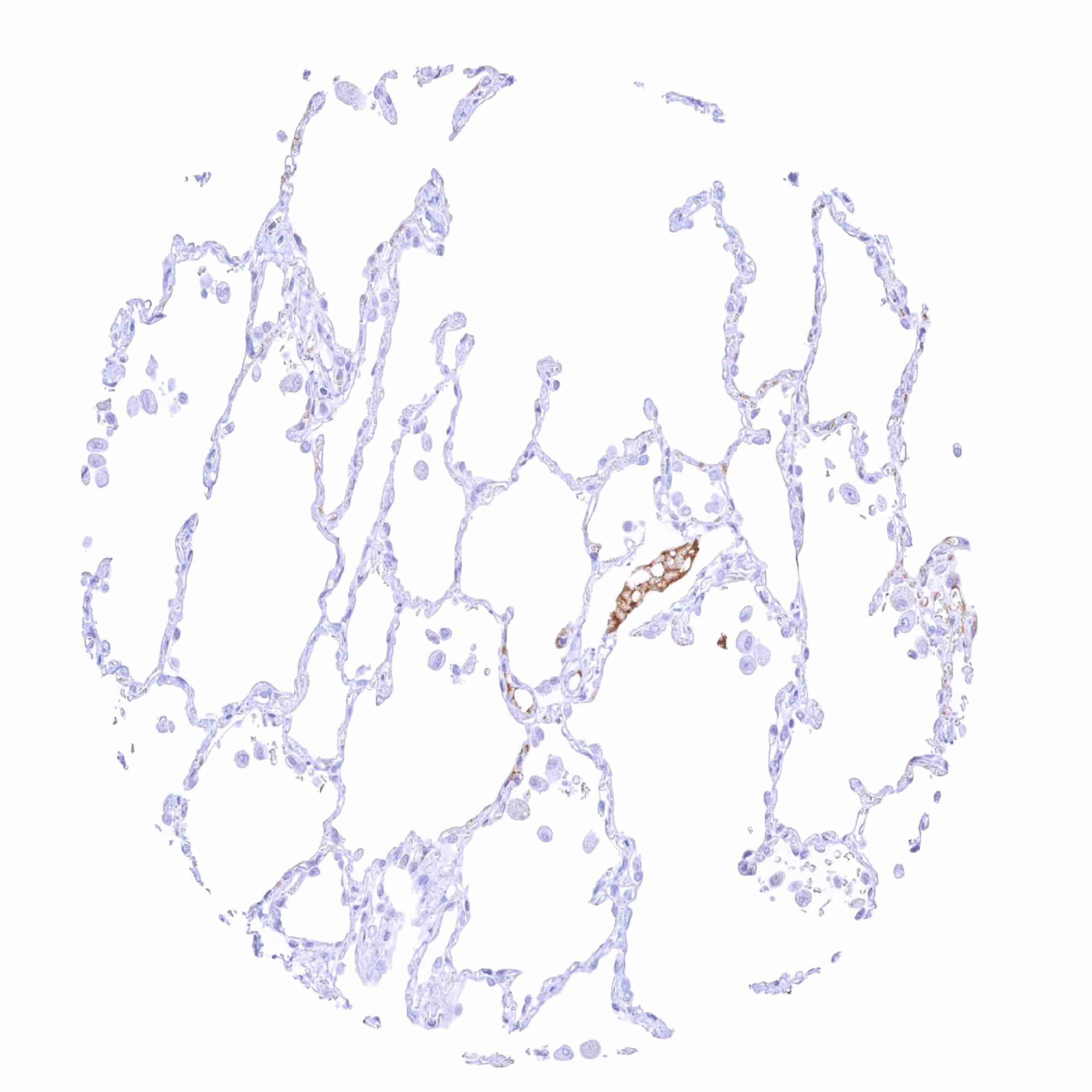 IgD (Immunglobulin D) (MSVA-701R) - MS Validated Antibodies