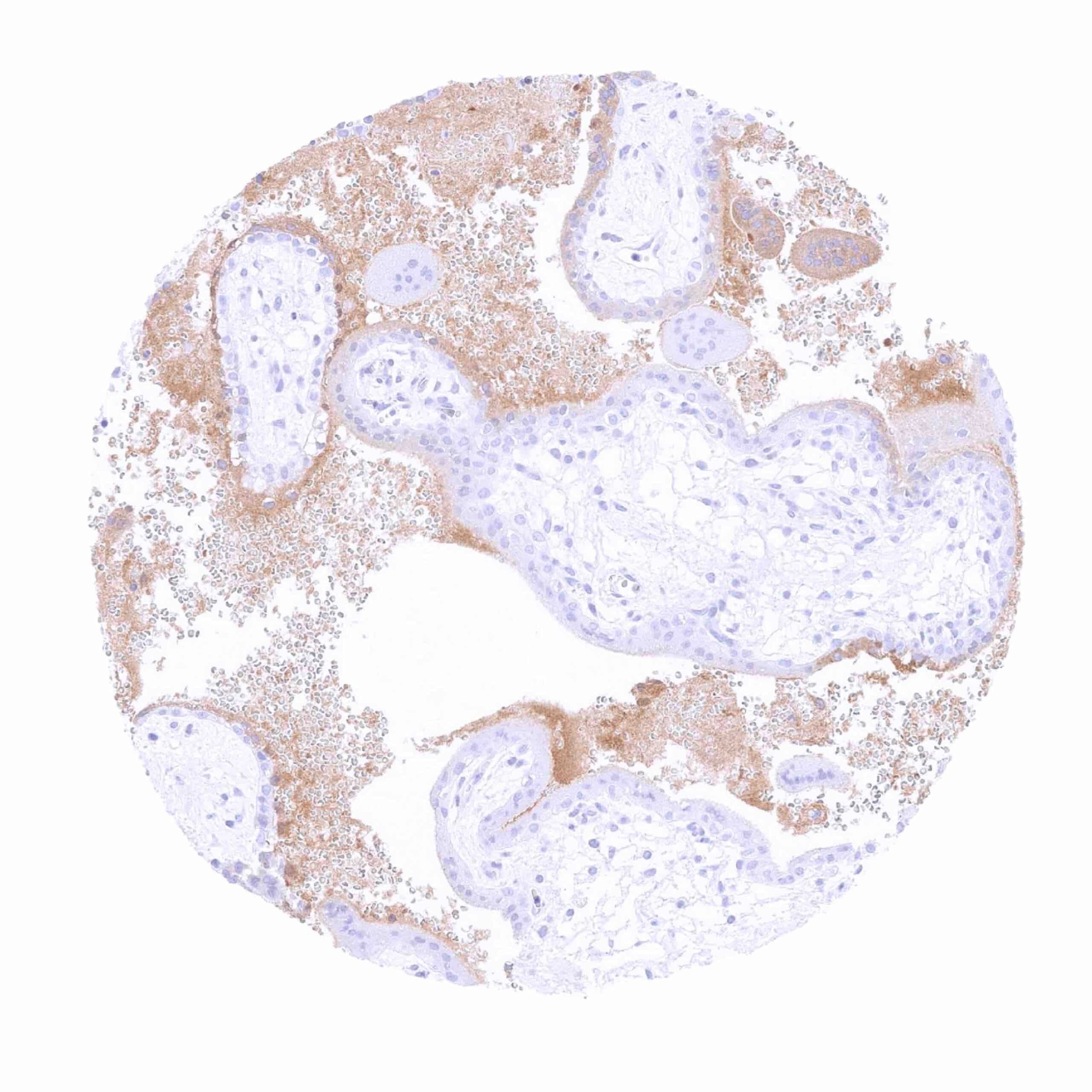 IgD (Immunglobulin D) (MSVA-701R) - MS Validated Antibodies