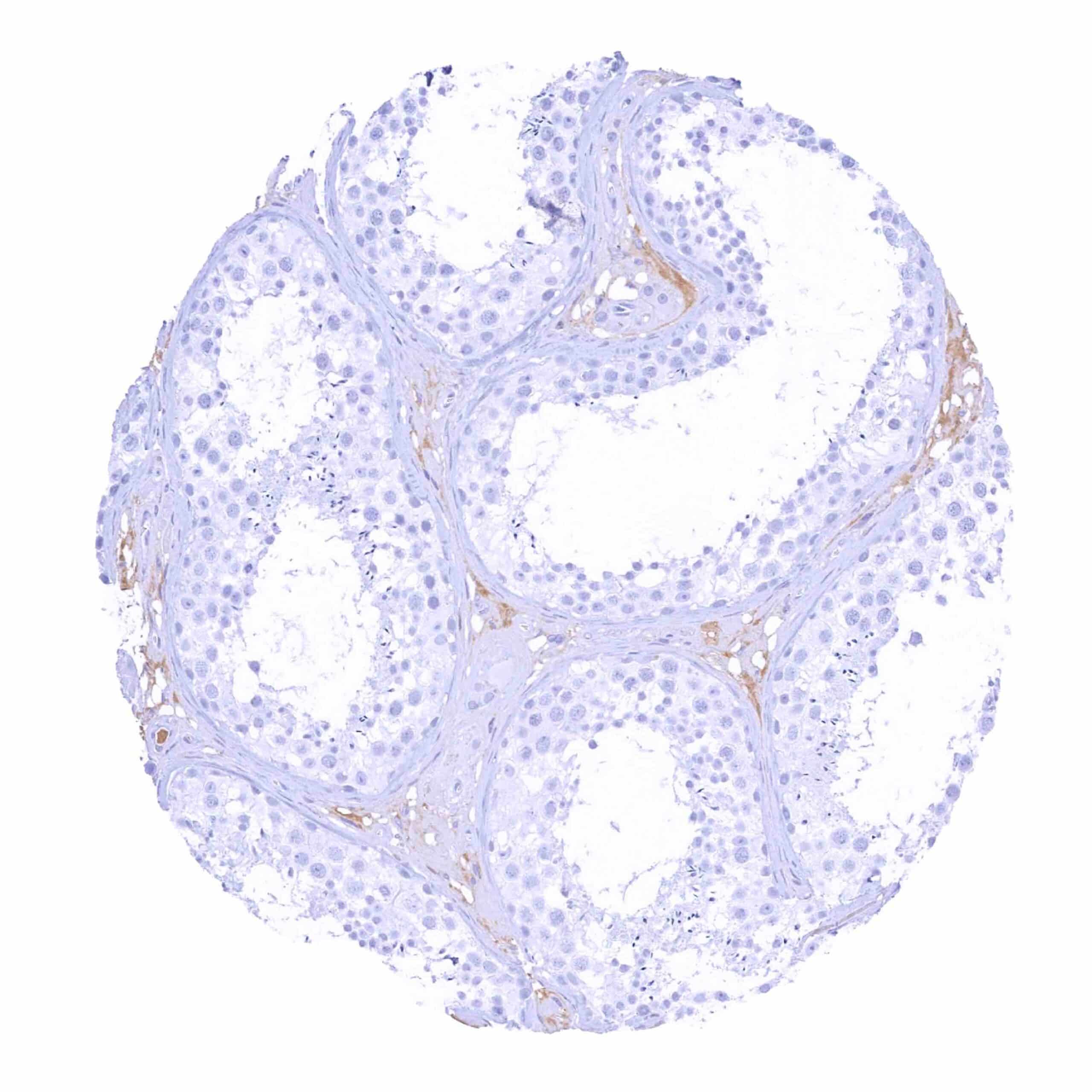 IgD (Immunglobulin D) (MSVA-701R) - MS Validated Antibodies