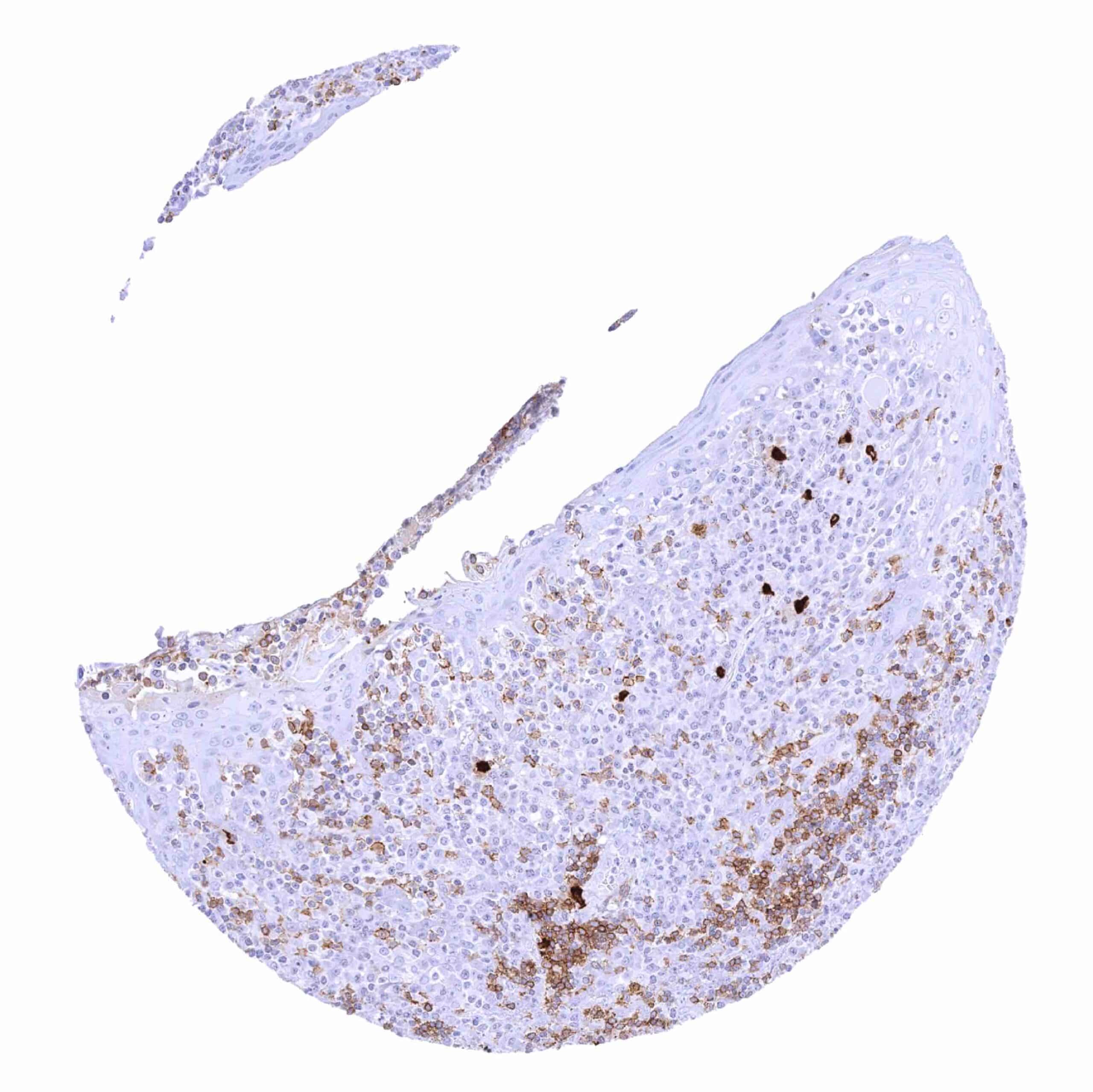 IgD (Immunglobulin D) (MSVA-701R) - MS Validated Antibodies