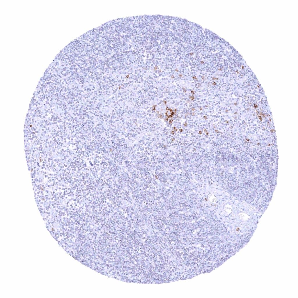 IgD (Immunglobulin D) (MSVA-701R) - MS Validated Antibodies IgD (Immunglobulin D) (MSVA-701R) - MS Validated Antibodies