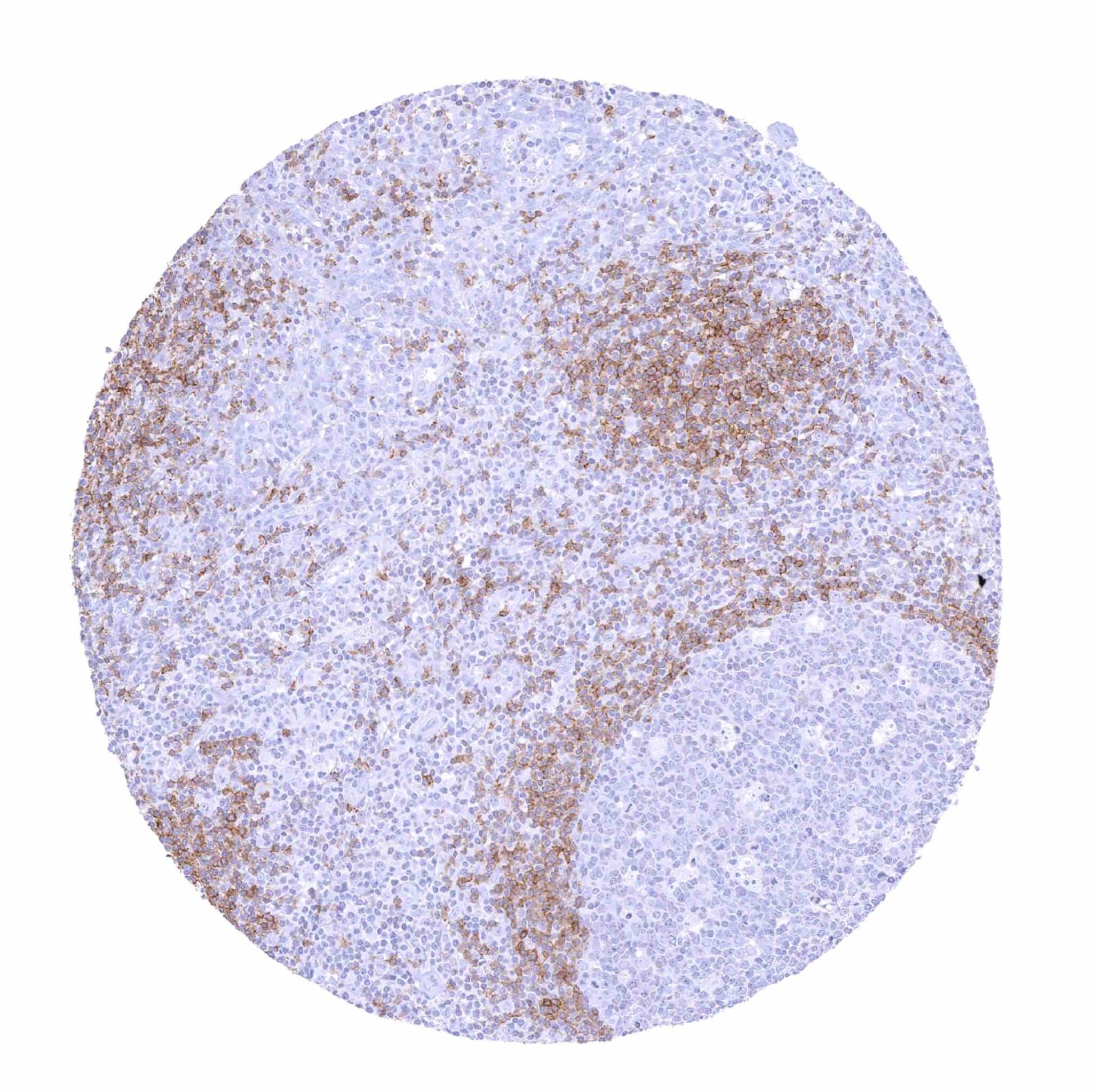 IgD (Immunglobulin D) (MSVA-701R) - MS Validated Antibodies IgD (Immunglobulin D) (MSVA-701R) - MS Validated Antibodies