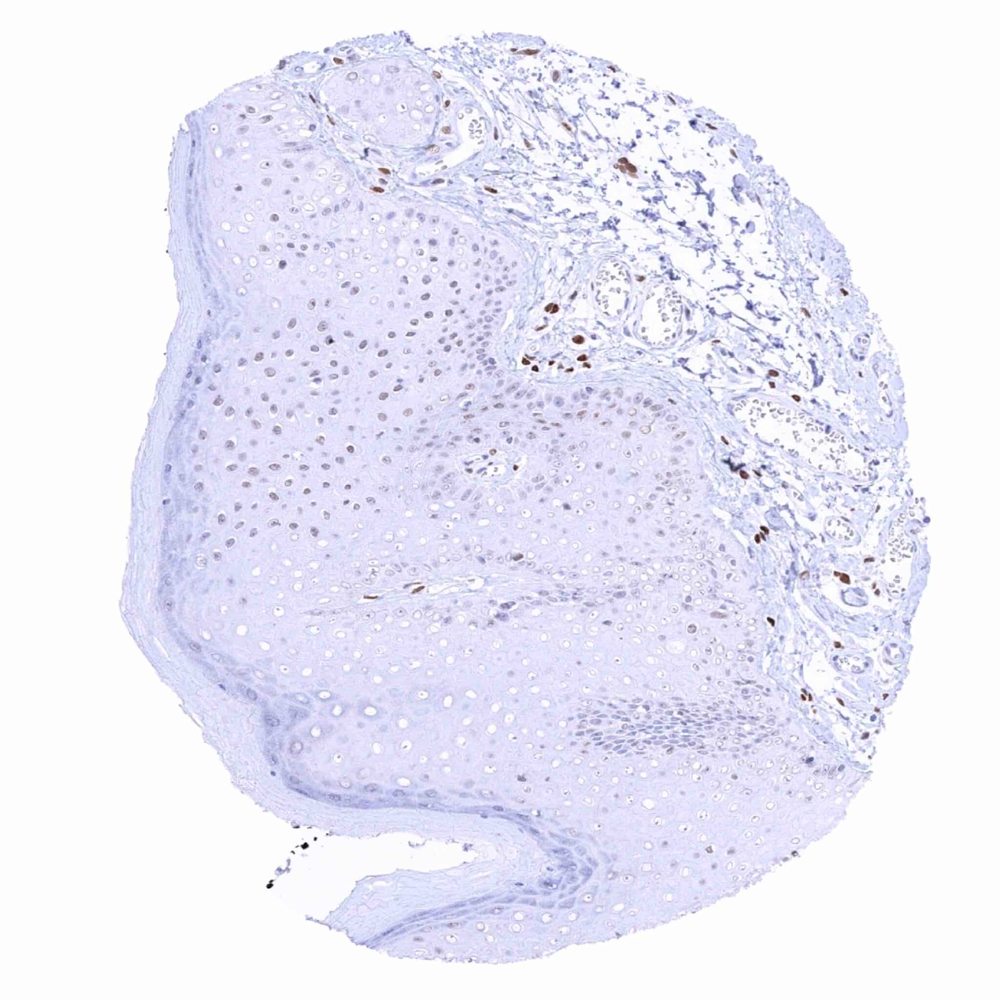 Normal Tissue Gallery TRPS1 - MS Validated Antibodies