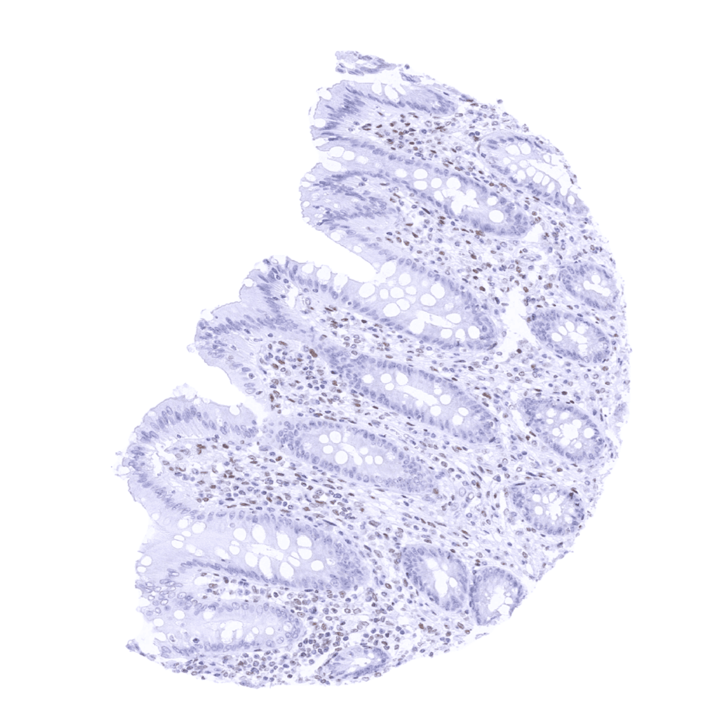TRPS1 (MSVA-512R) - MS Validated Antibodies