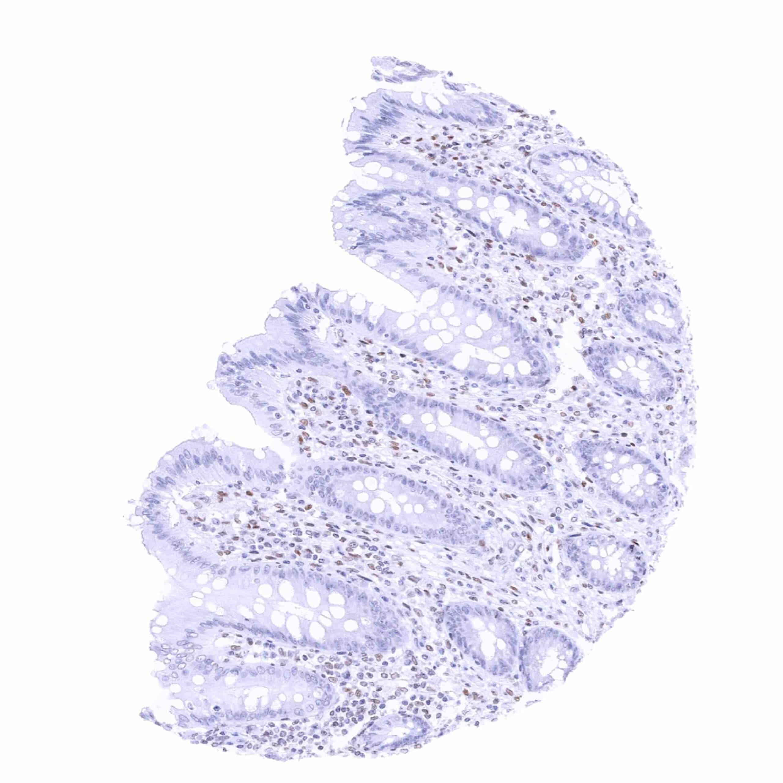 Normal Tissue Gallery TRPS1 - MS Validated Antibodies