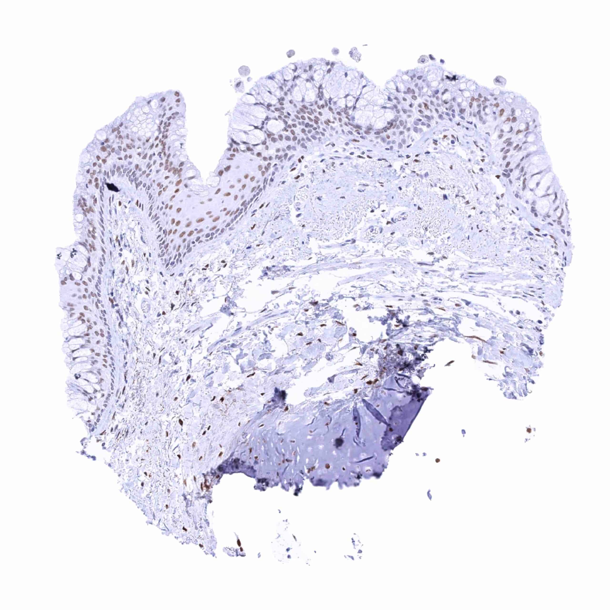 Normal Tissue Gallery TRPS1 - MS Validated Antibodies