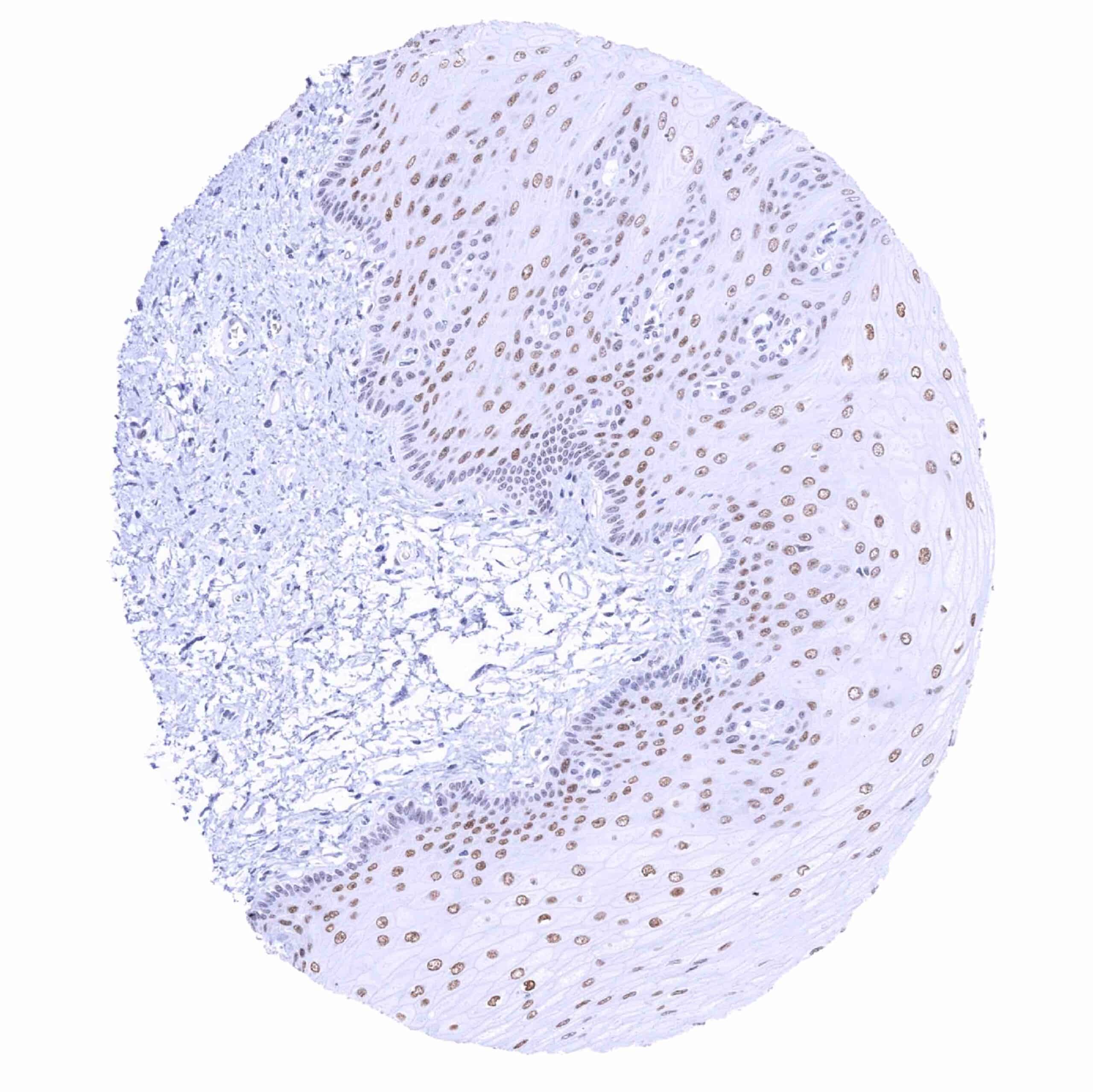 Normal Tissue Gallery TRPS1 - MS Validated Antibodies
