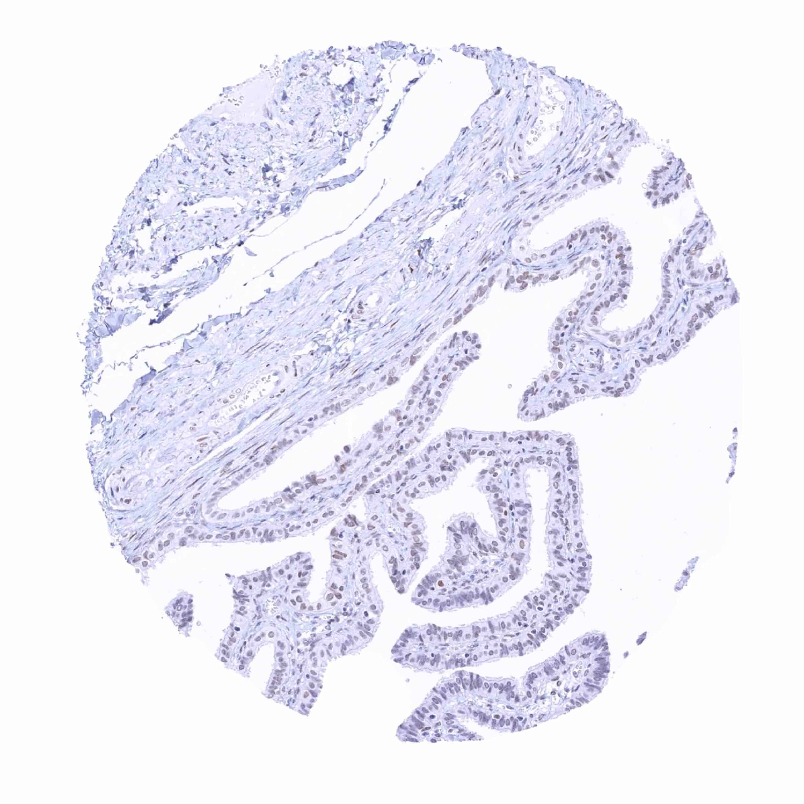 Normal Tissue Gallery TRPS1 - MS Validated Antibodies