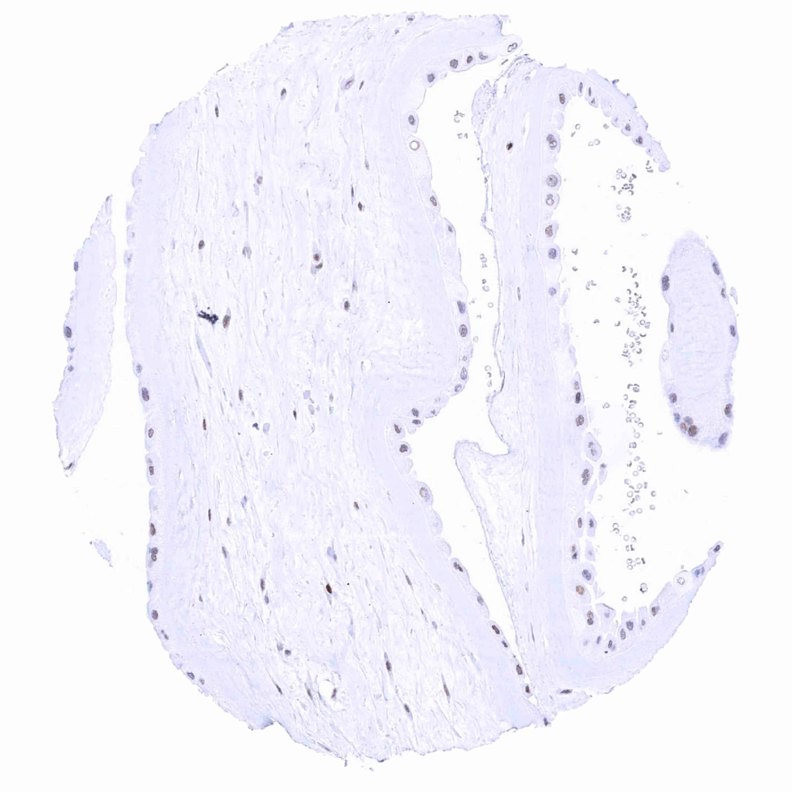 TRPS1 (MSVA-512R) - MS Validated Antibodies