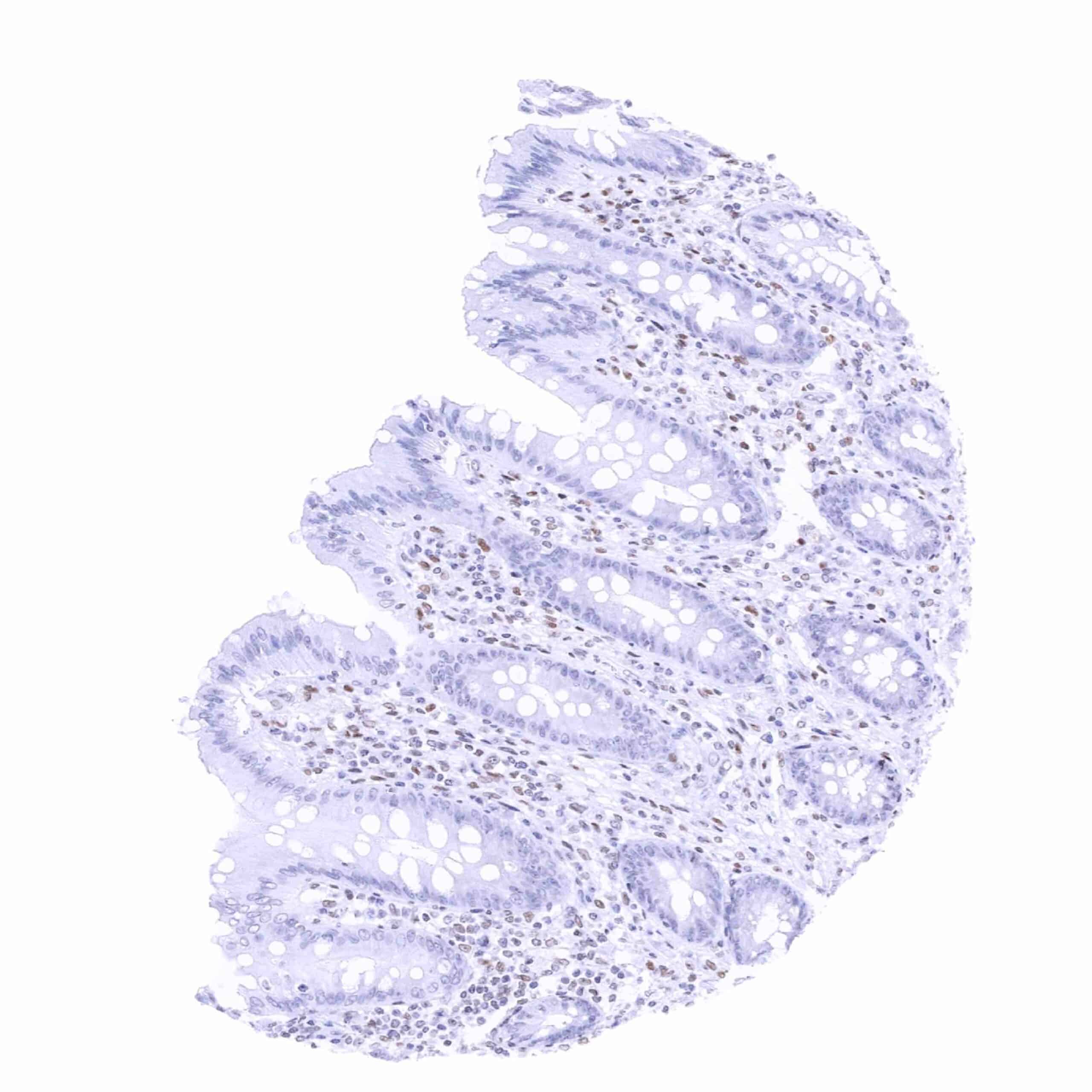 TRPS1 (MSVA-512R) - MS Validated Antibodies