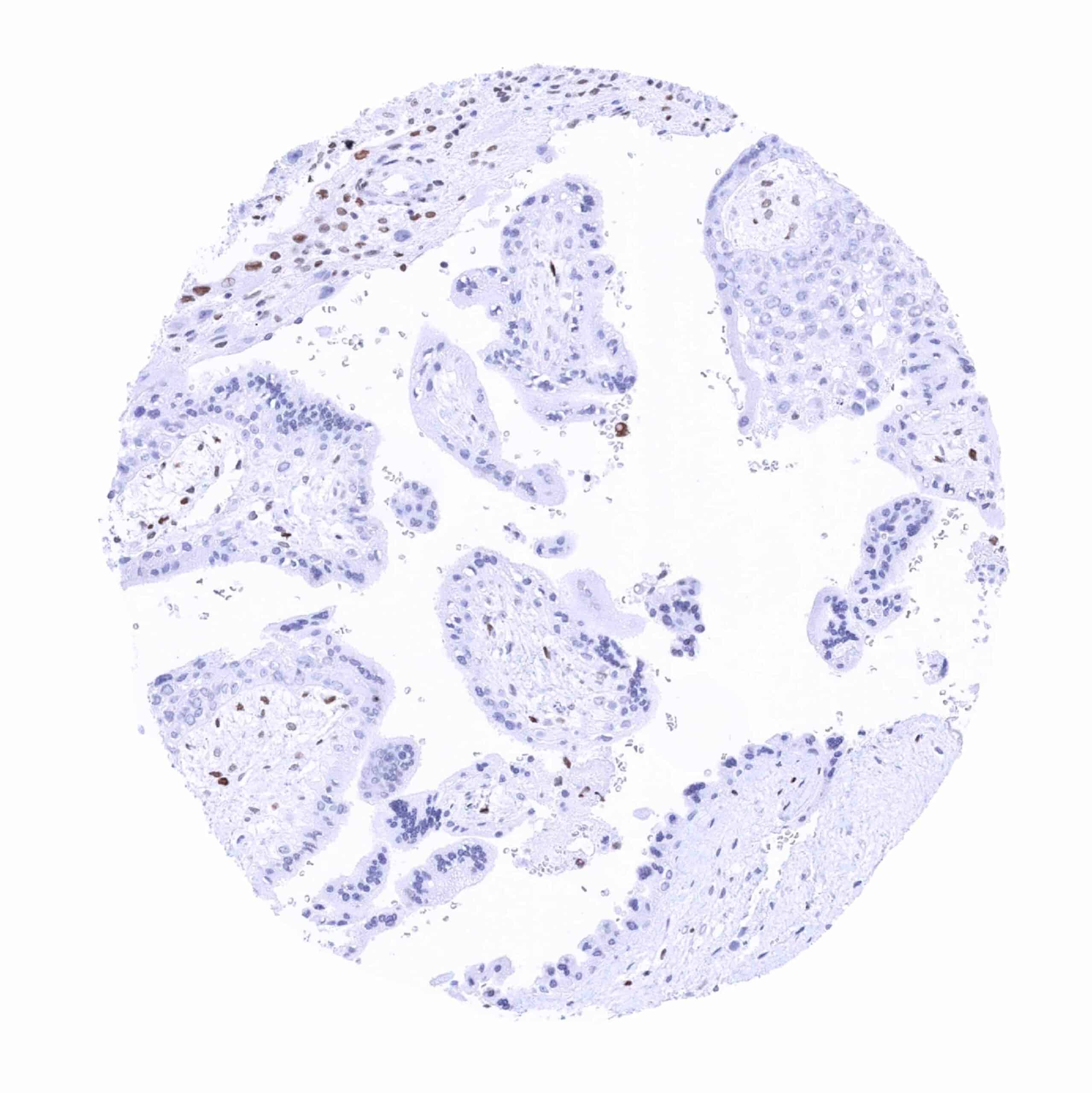 TRPS1 (MSVA-512R) - MS Validated Antibodies