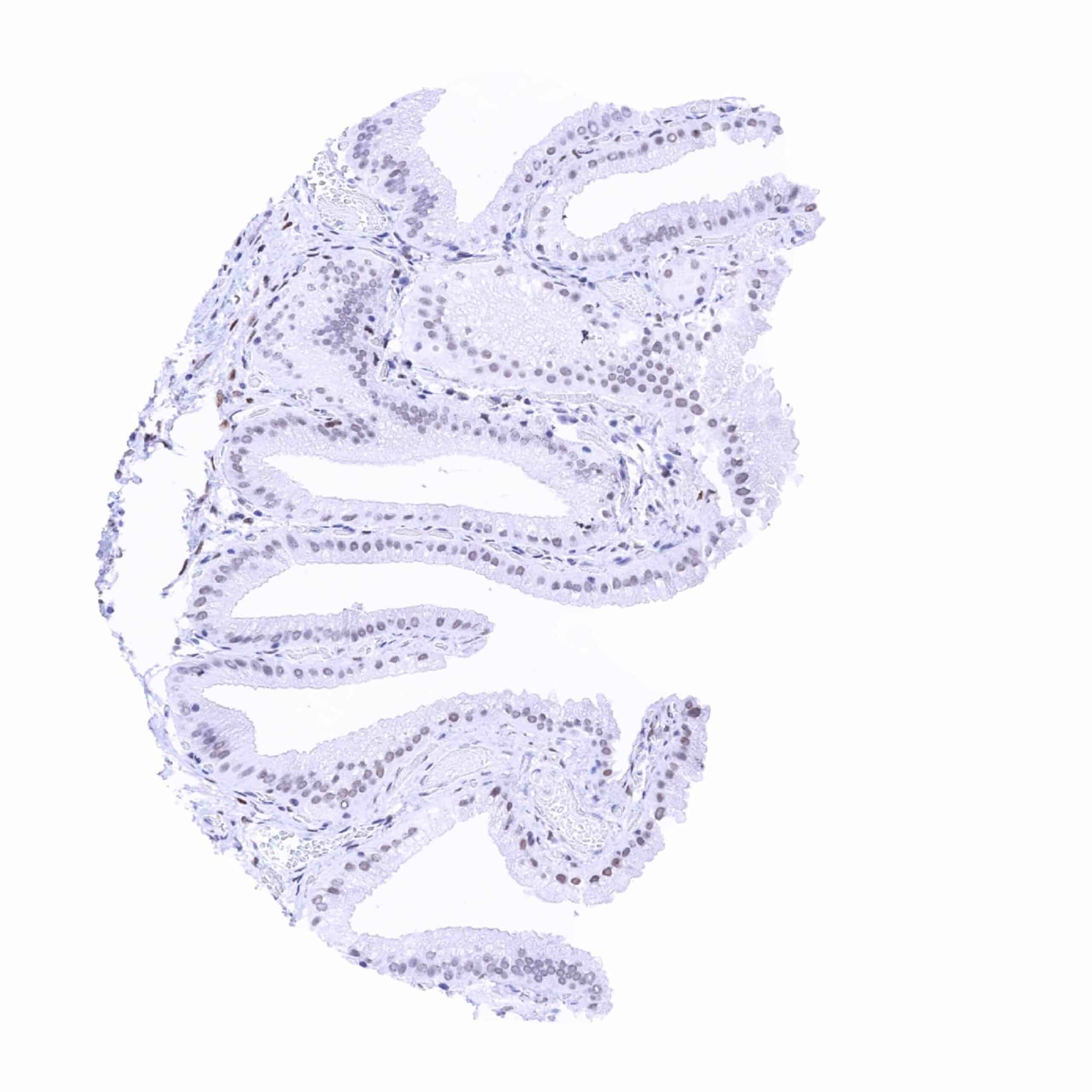 TRPS1 (MSVA-512R) - MS Validated Antibodies