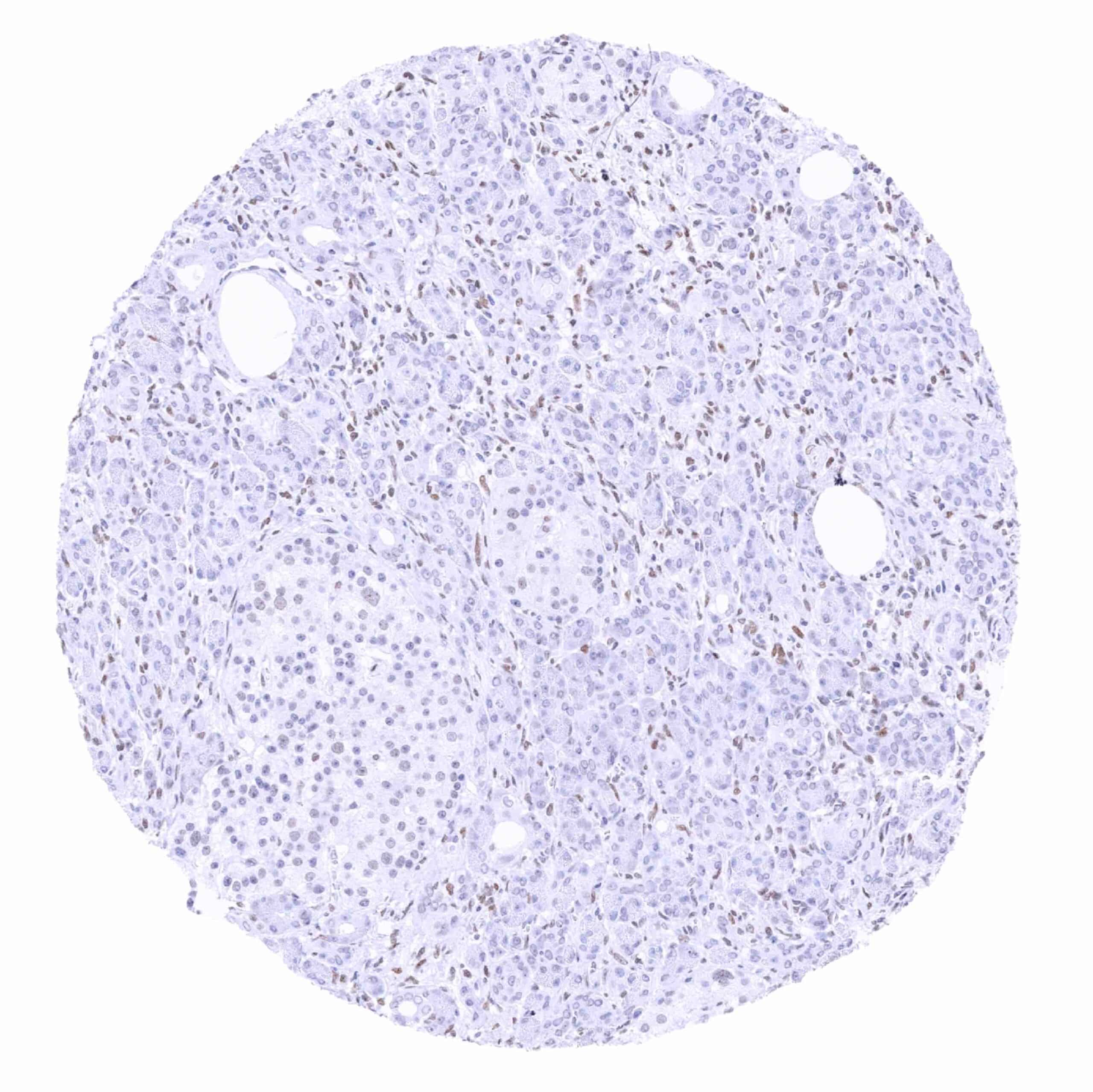 TRPS1 (MSVA-512R) - MS Validated Antibodies