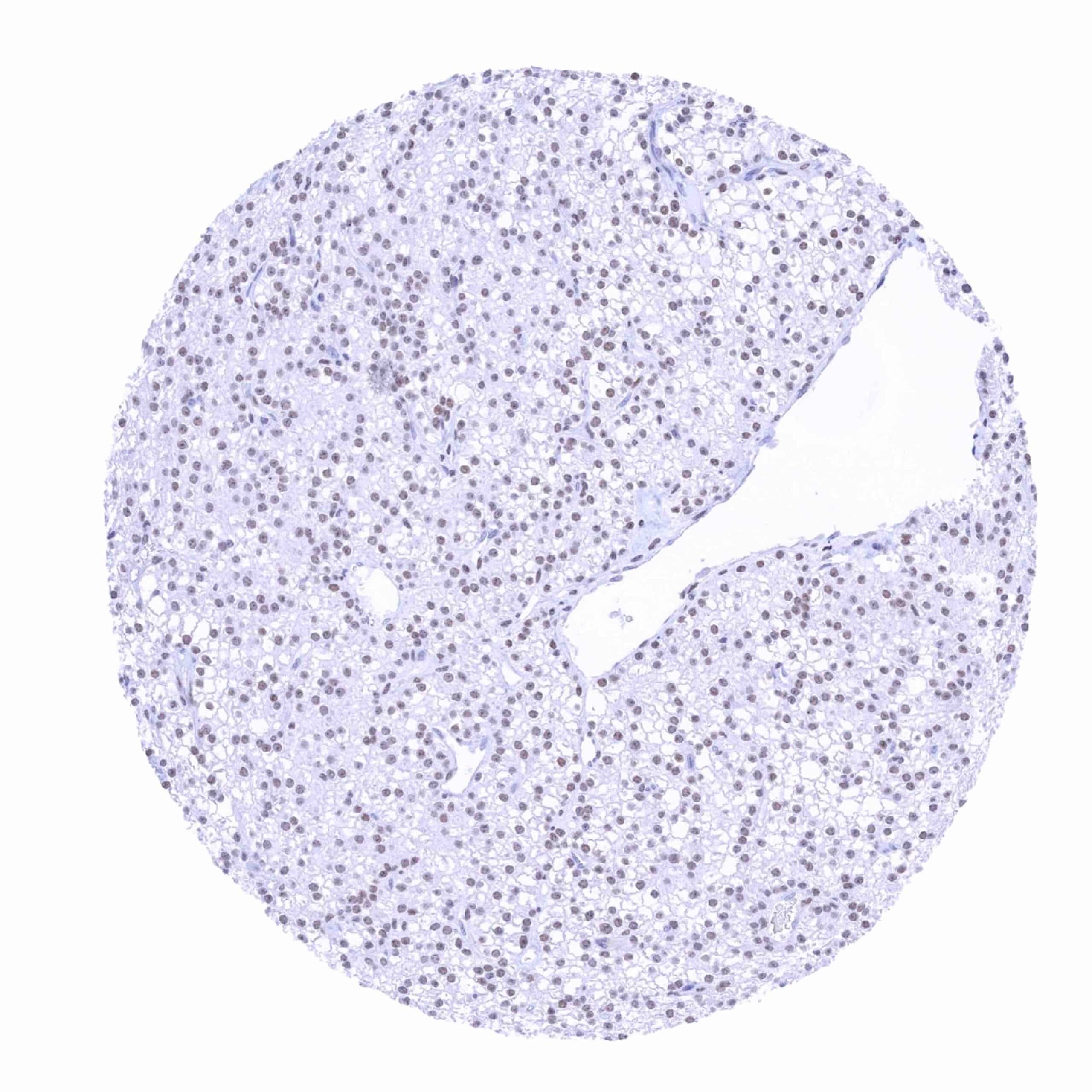 TRPS1 (MSVA-512R) - MS Validated Antibodies