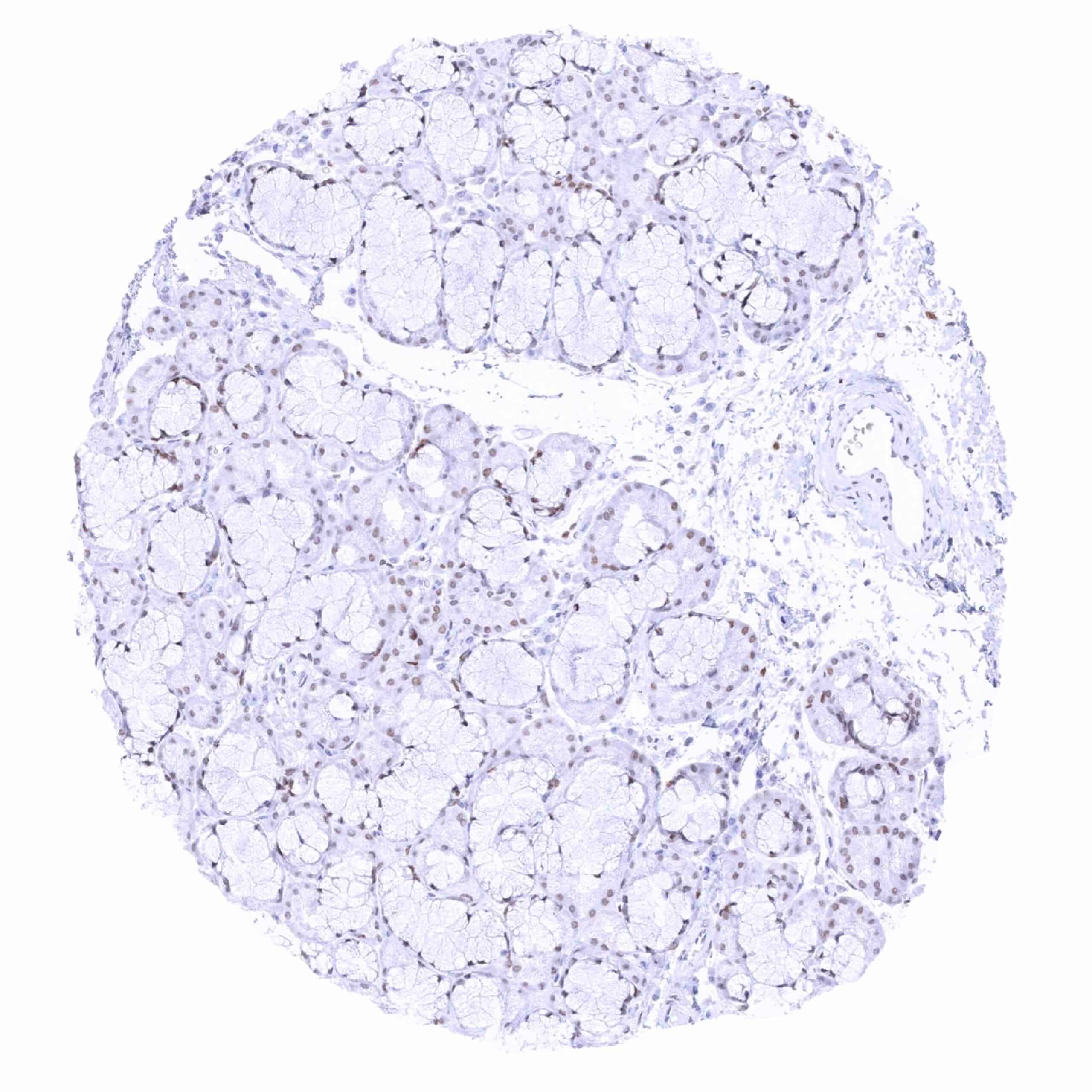 TRPS1 (MSVA-512R) - MS Validated Antibodies