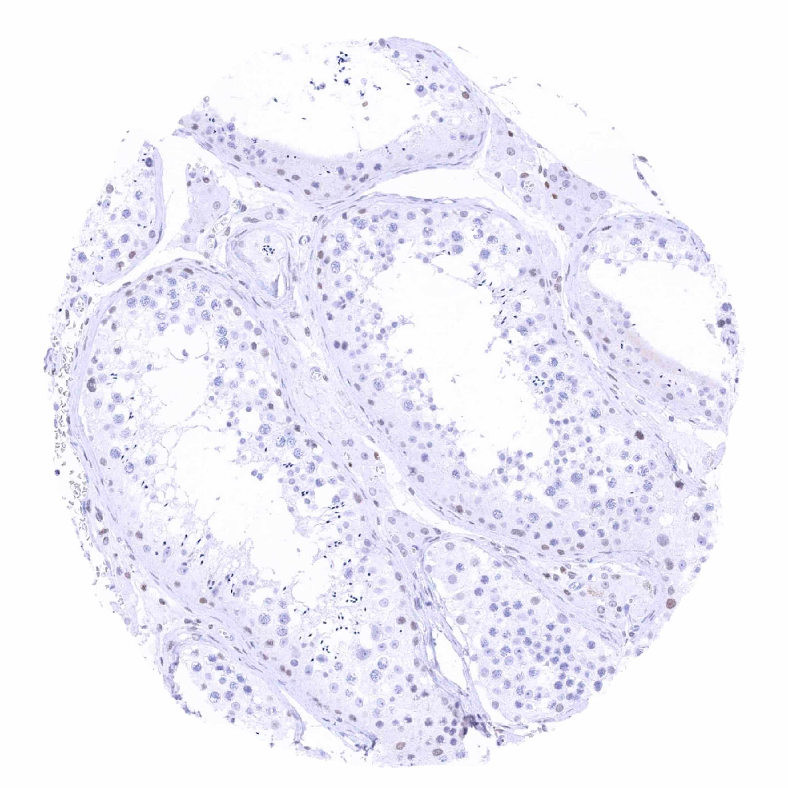 TRPS1 (MSVA-512R) - MS Validated Antibodies