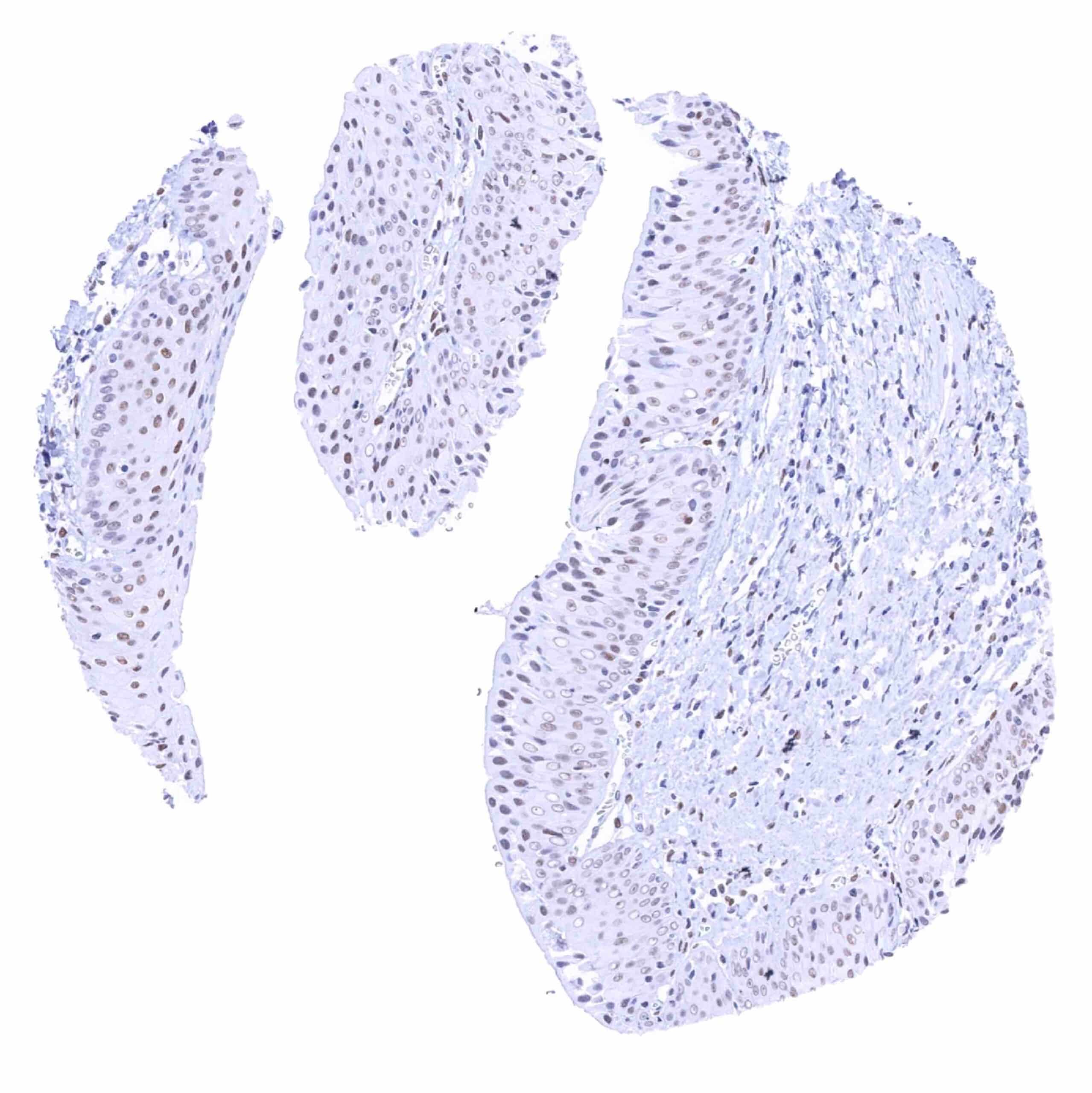 TRPS1 (MSVA-512R) - MS Validated Antibodies